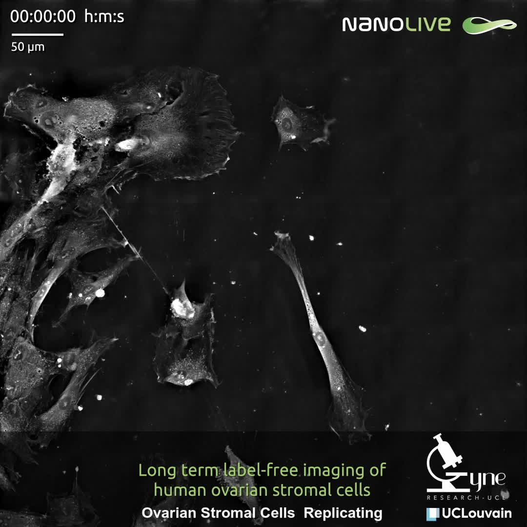 Ovarian Stromal Cells Replicating | Scrolller