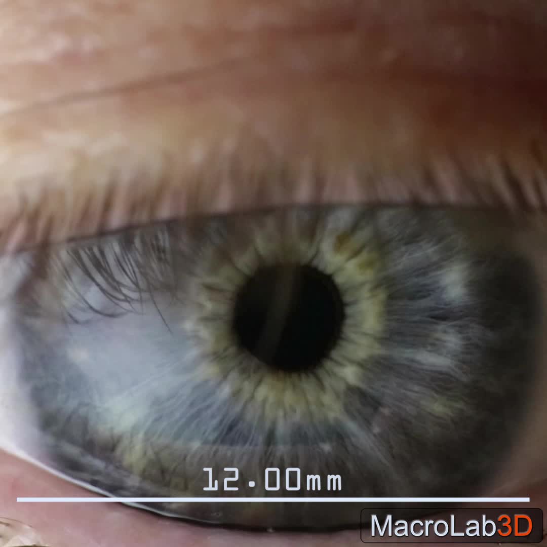 [OC] Iris: | Scrolller