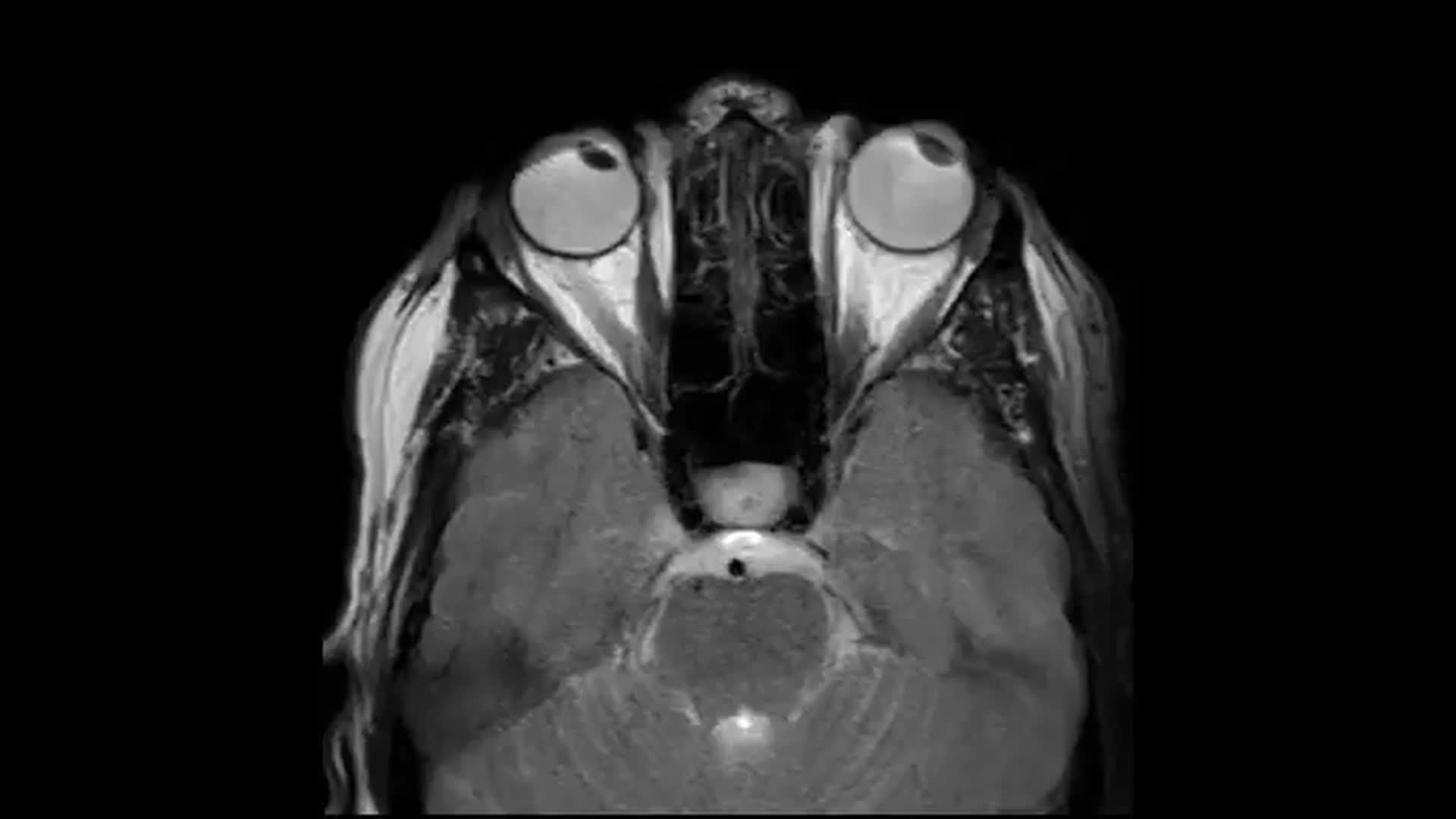 MRI scan of a person moving their eyes | Scrolller