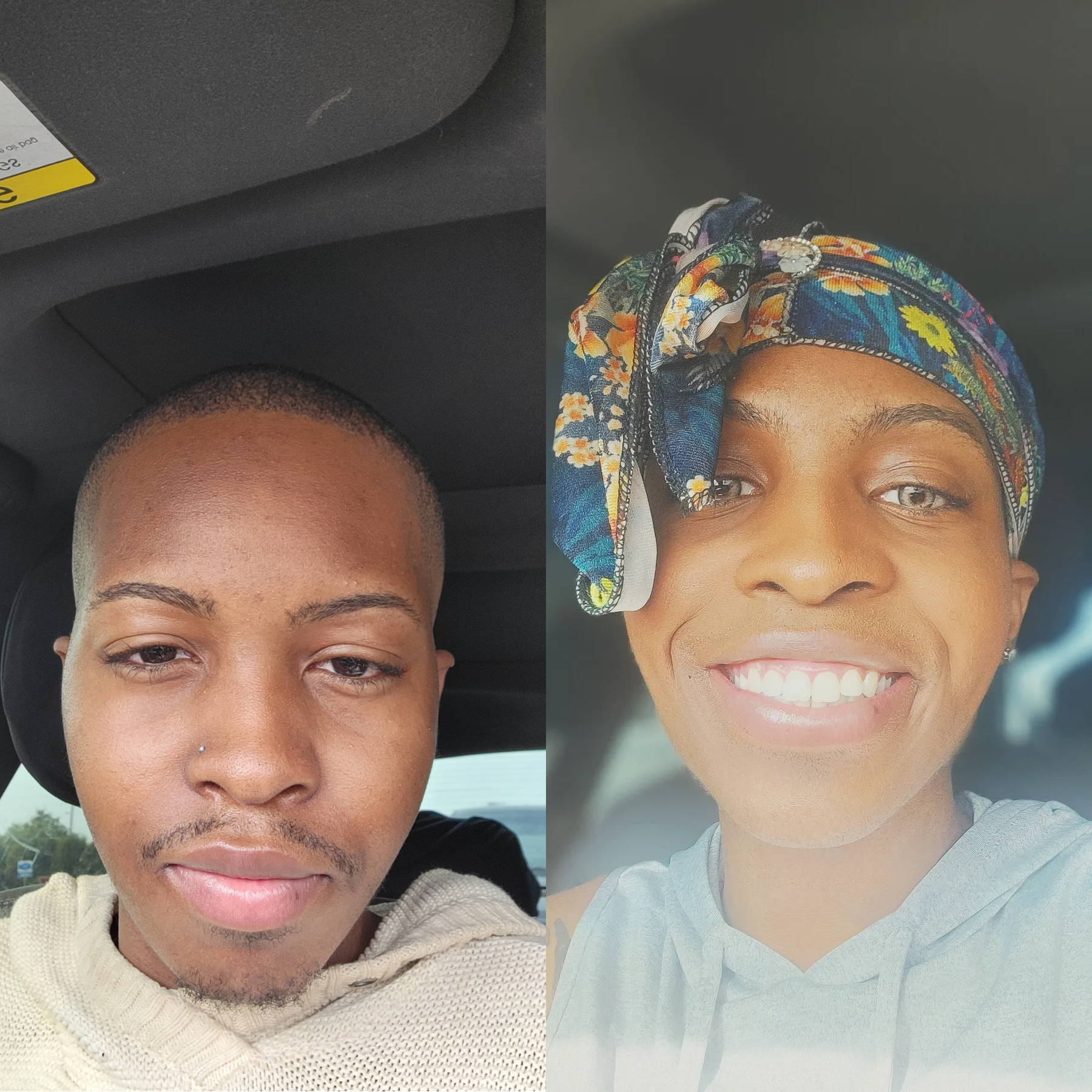 -1 year vs 5 months hrt😀 | Scrolller
