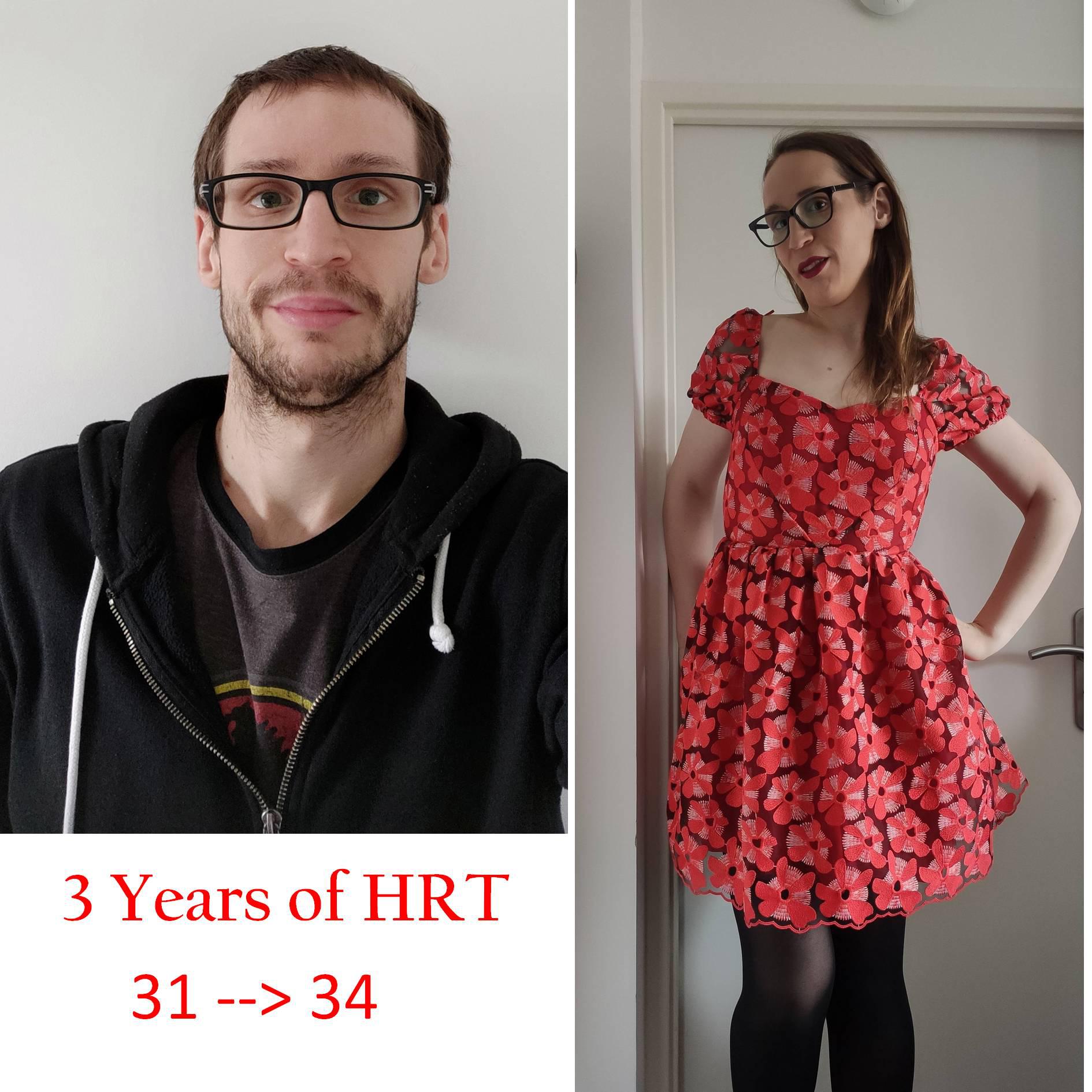 3 Years of HRT | Scrolller