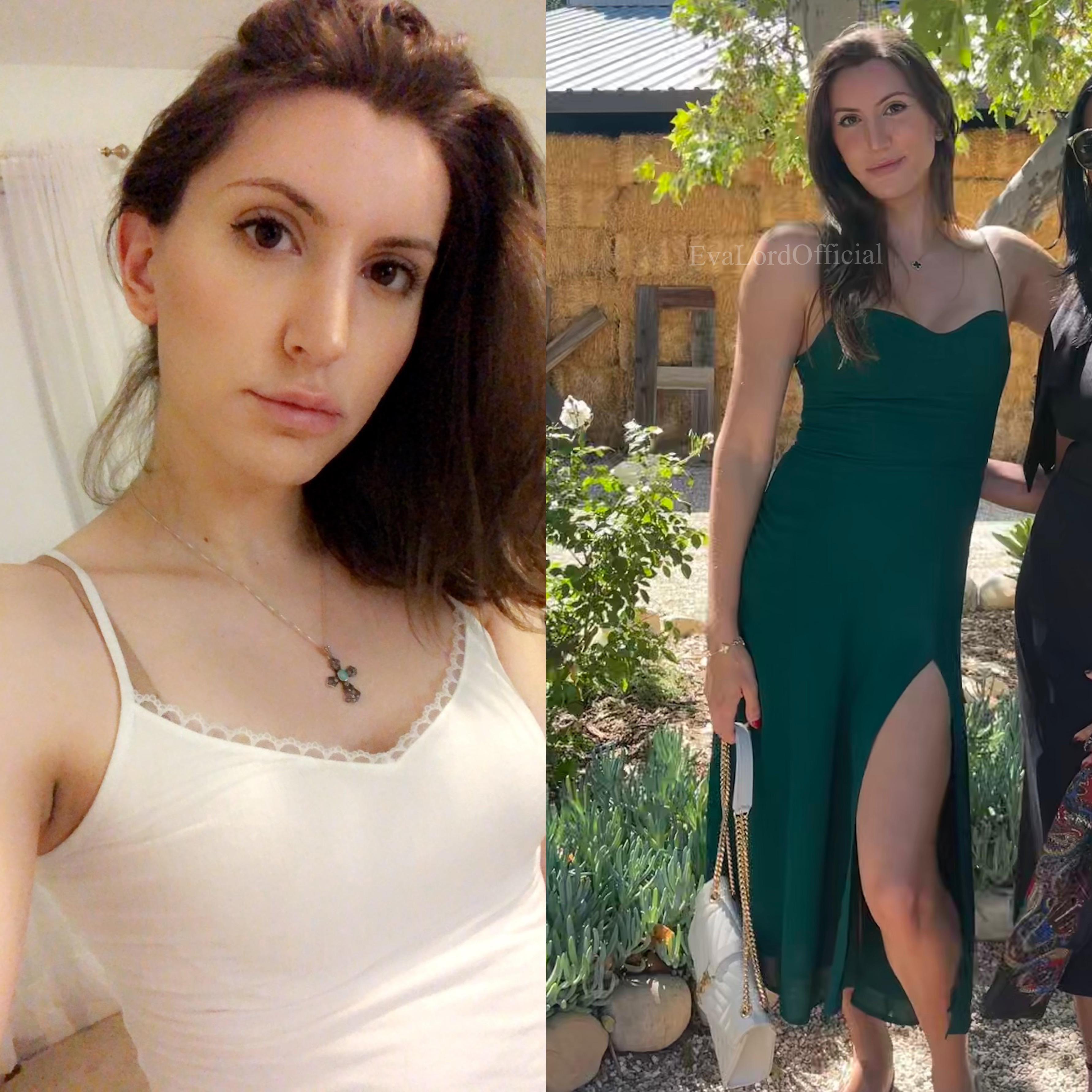 30yo MtF 1.5 years vs 5 years on HRT. Changes do not stop after 2 years! 💖 | Scrolller