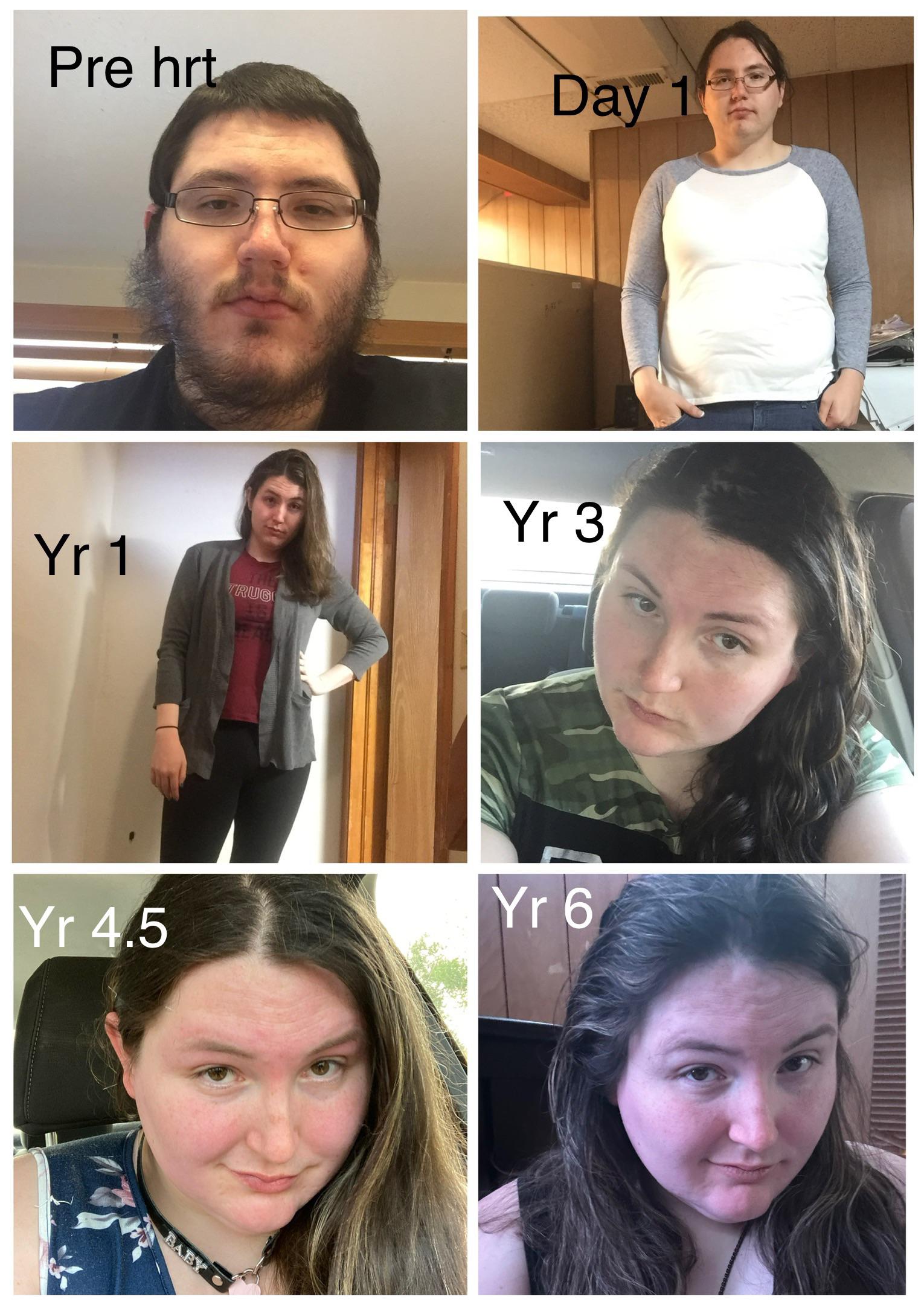 6 yrs of hrt | Scrolller