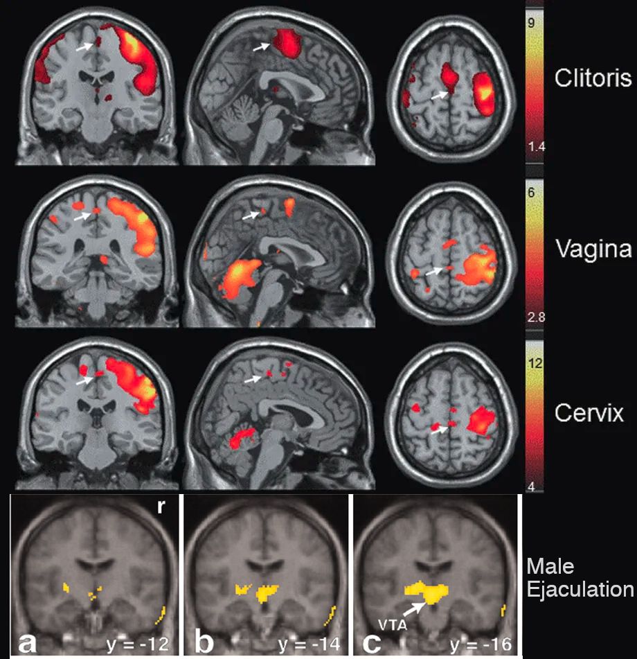 A look at orgasms during an MRI scan | Scrolller