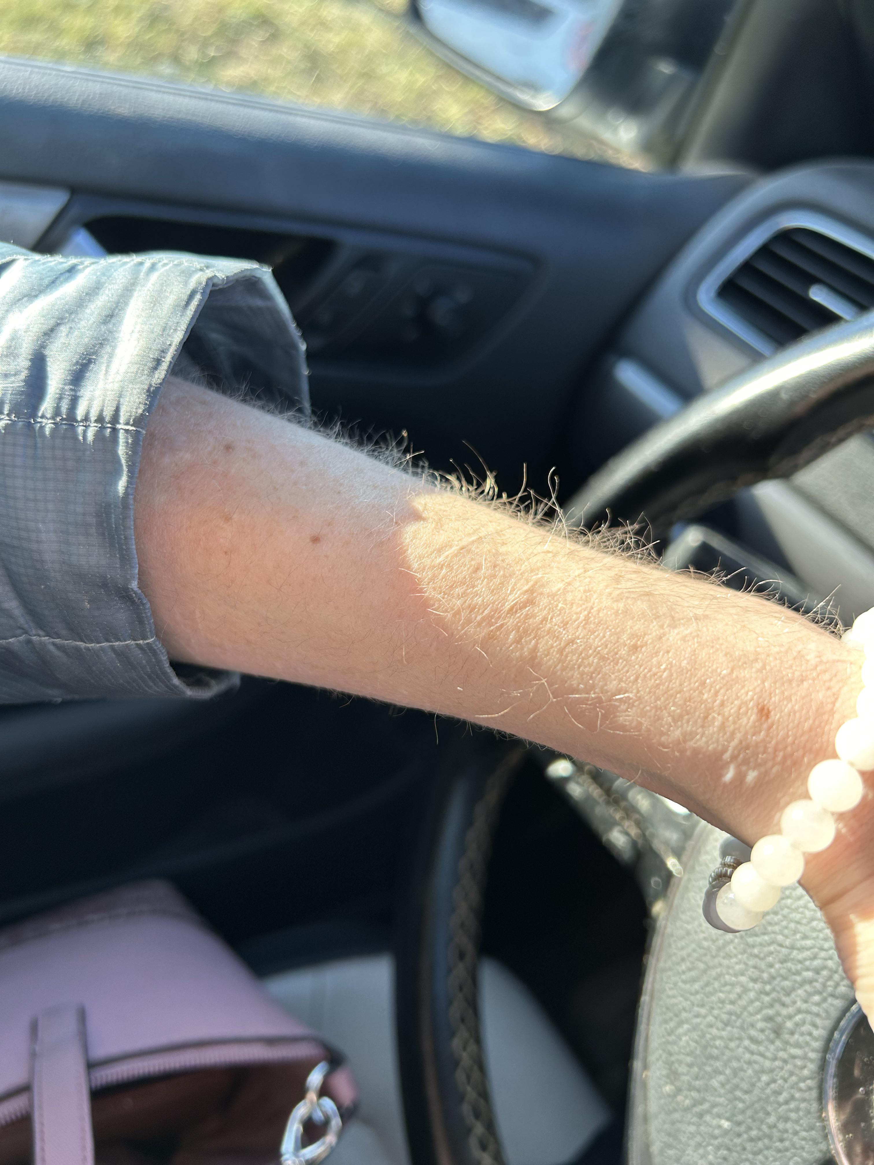 Blonde fuzzy arms | Scrolller