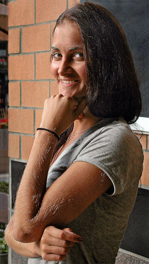 Fuzzy smile | Scrolller