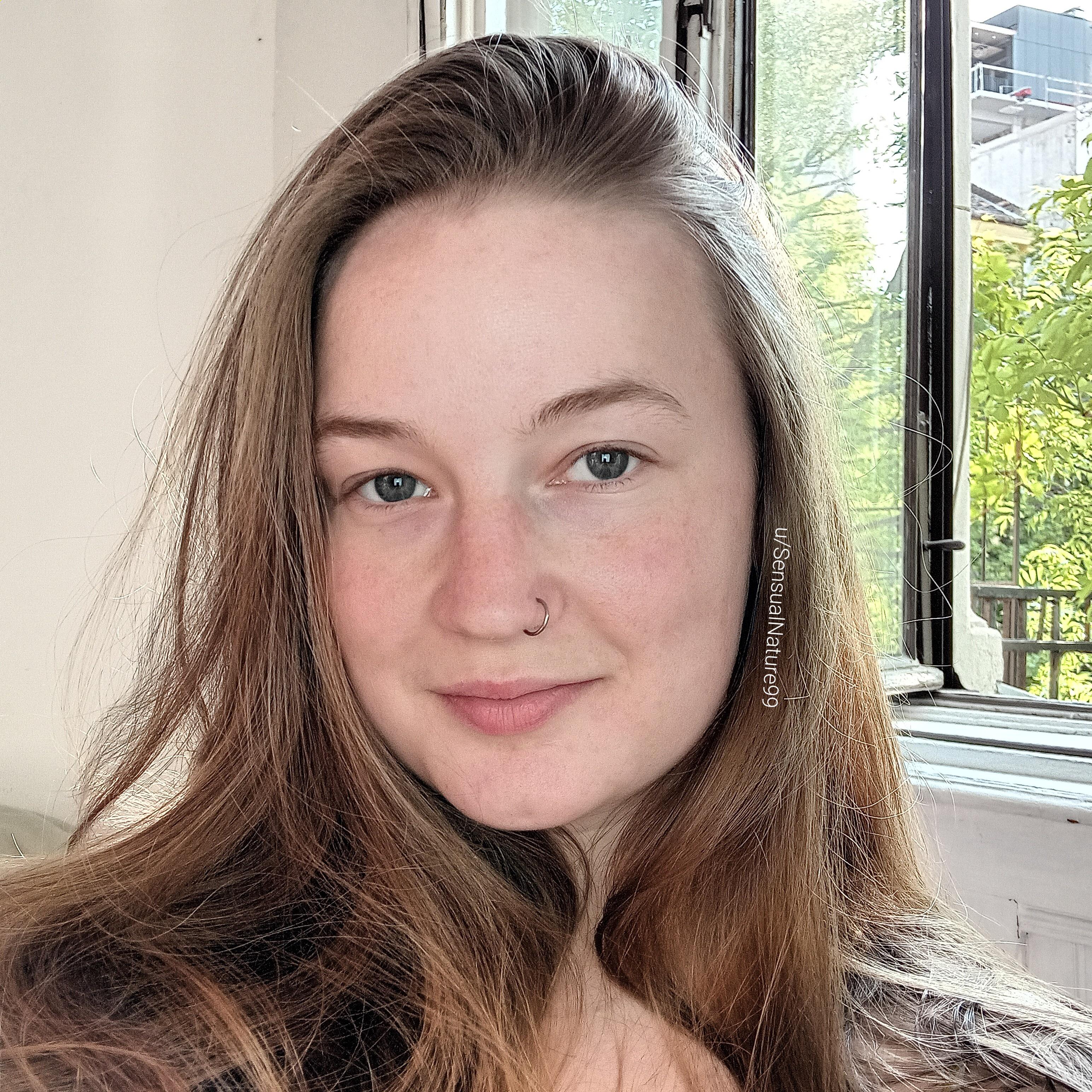 Love That The Freckles On My Face Are Showing More Now With The Warmer