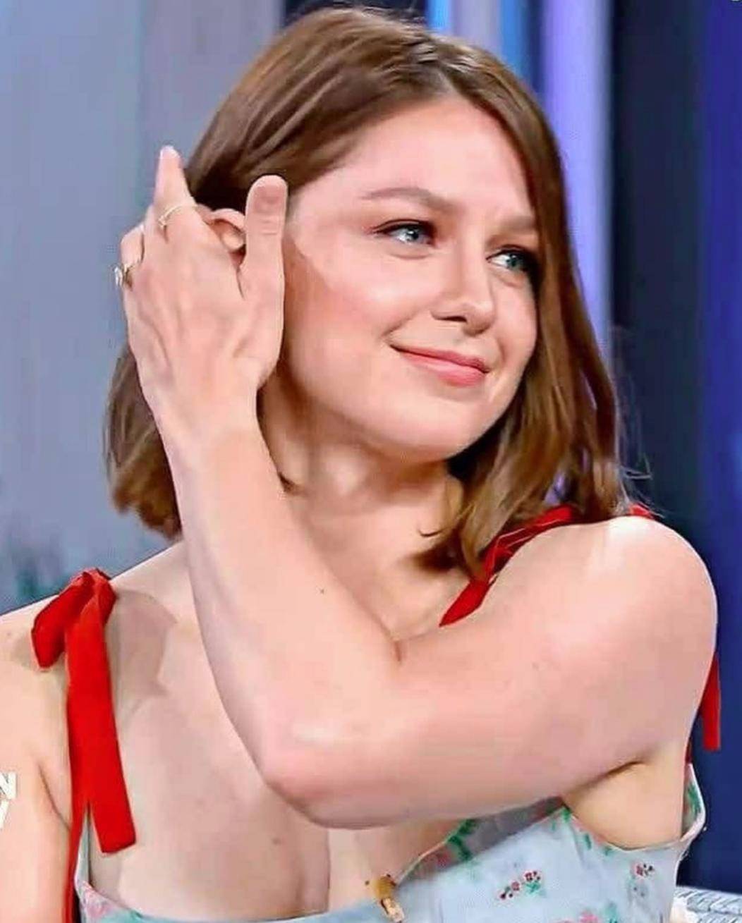 Melissa Benoist and her hot arms | Scrolller