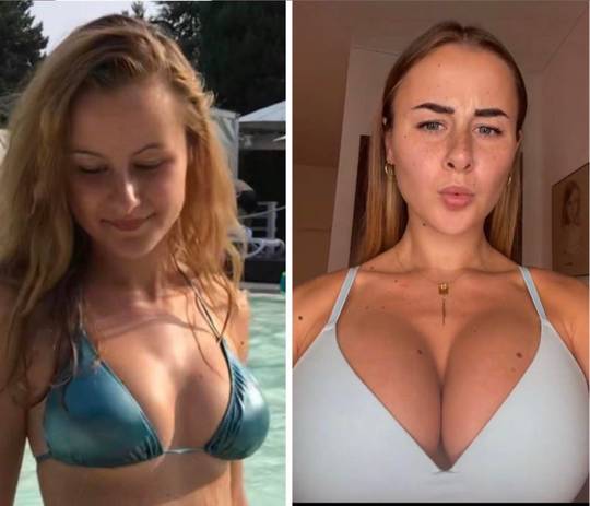 Nanda Alfi | Scrolller