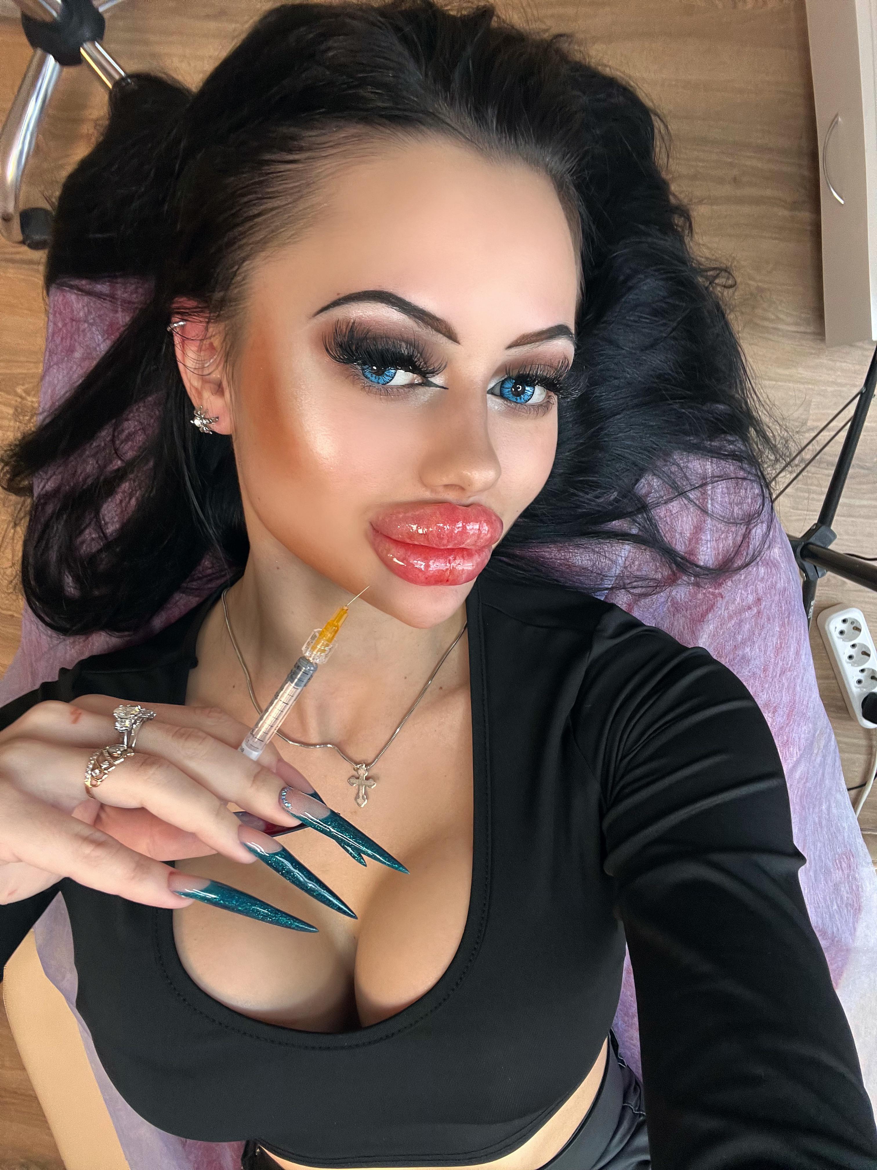 New injection, 27th cc | Scrolller