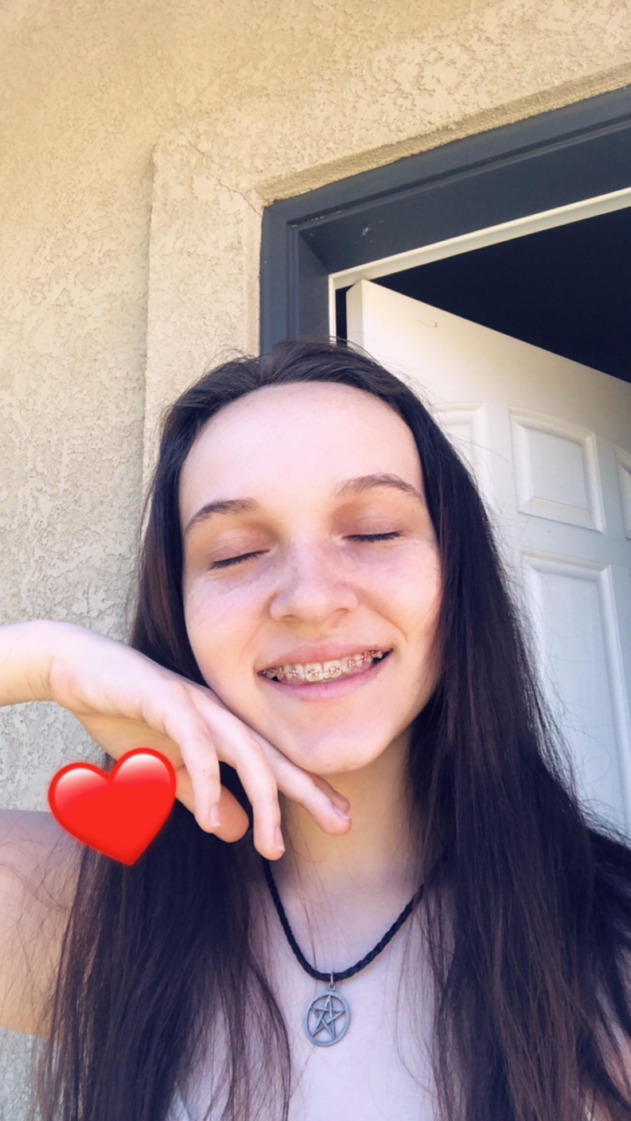 Sometimes my braces make me feel extra cute | Scrolller