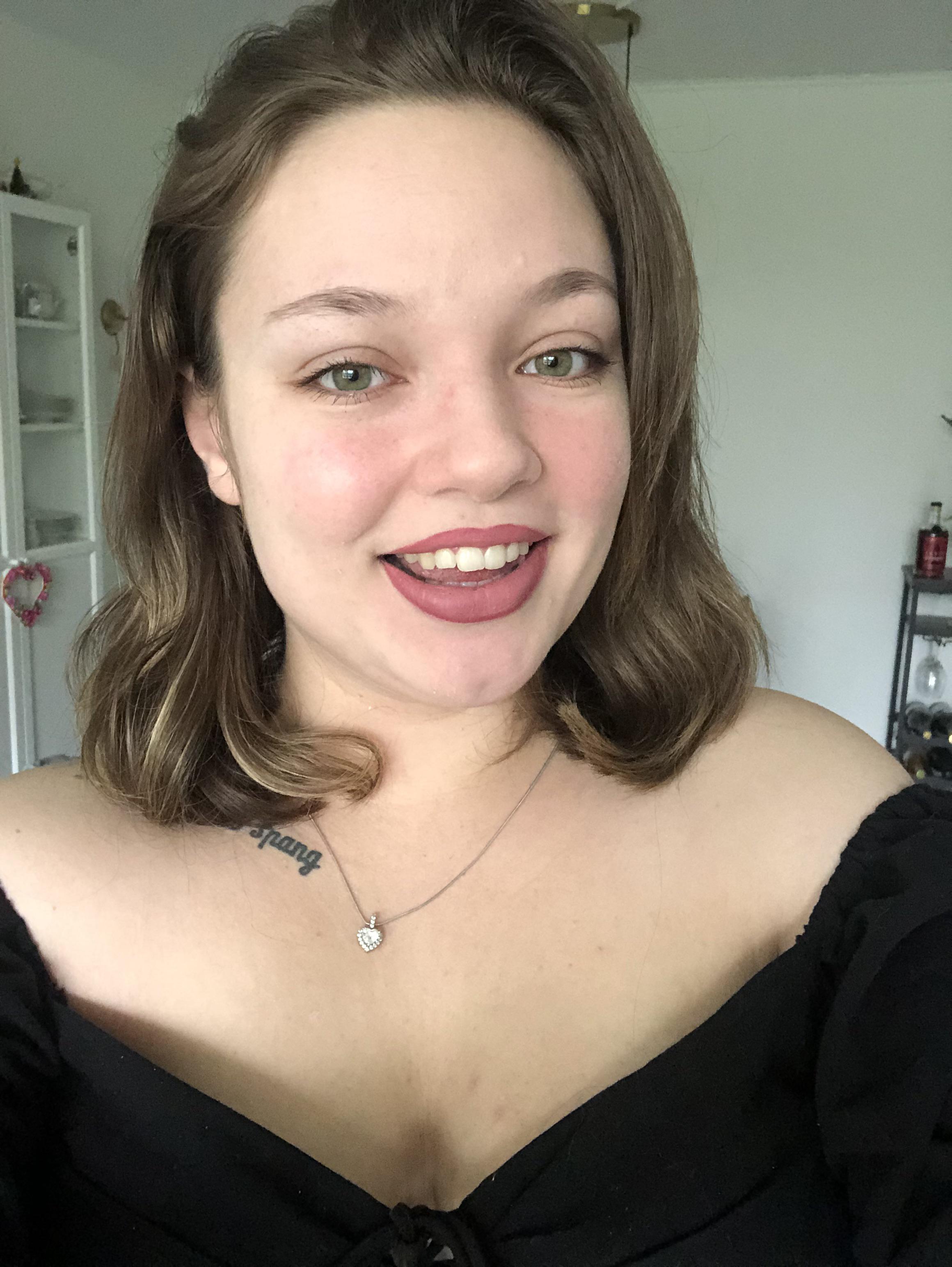 They look extra green today | Scrolller