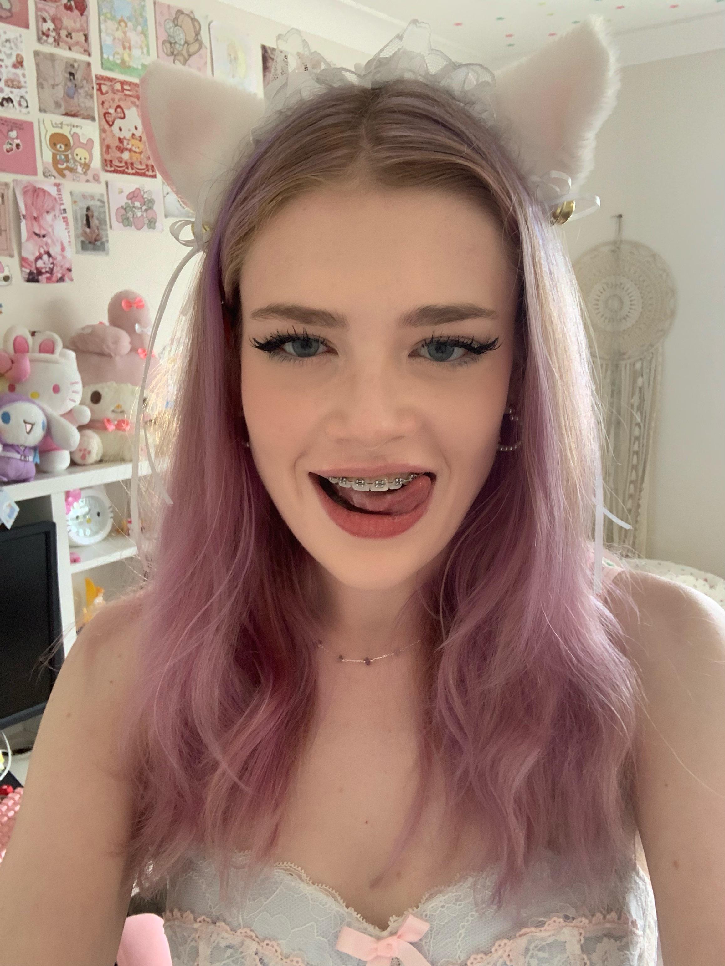 Would you cum on my braces? | Scrolller