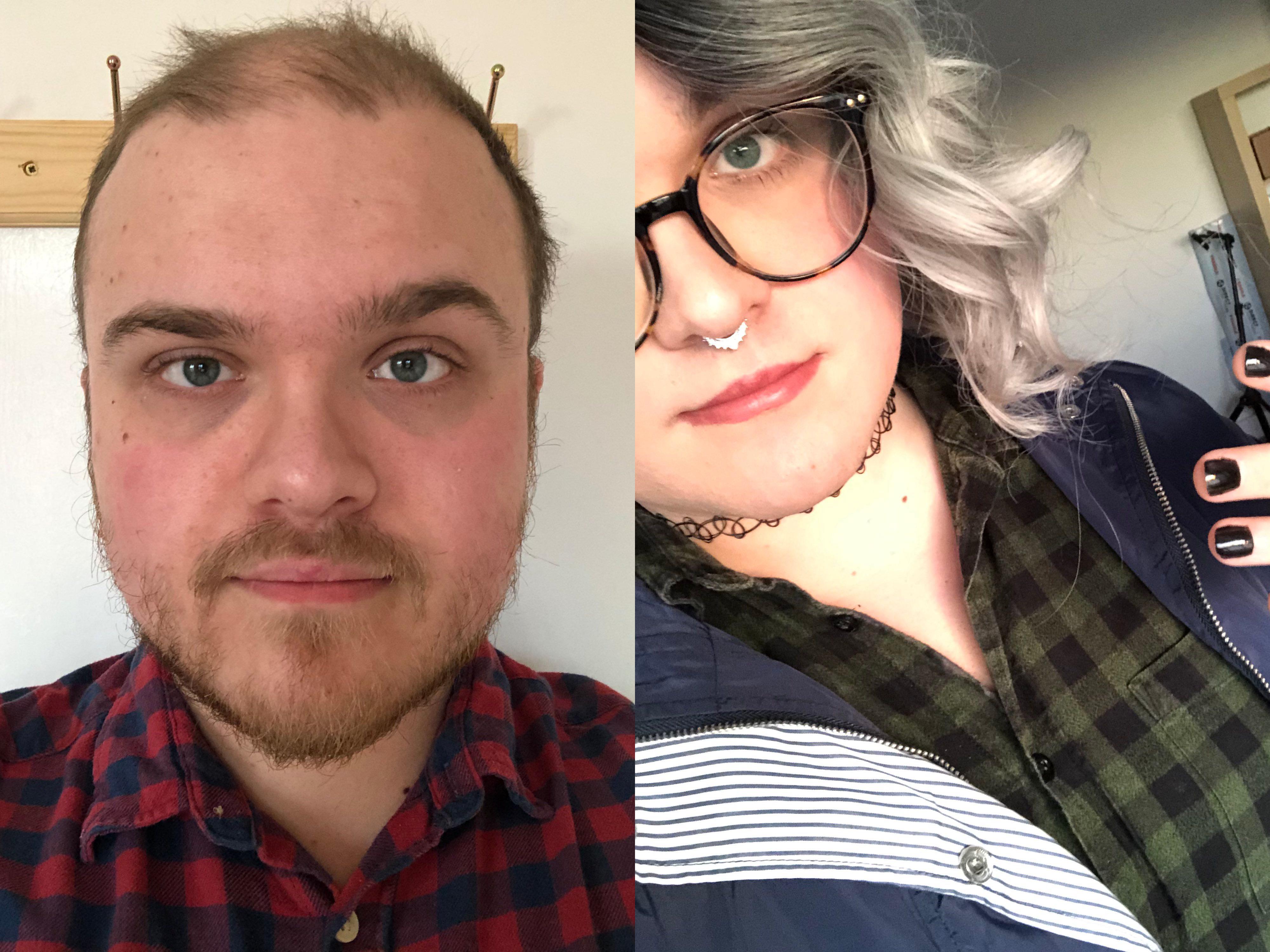 1 year, 6 months of HRT and minus 50lbs later. Things get better, I promise 💖 Merry Christmas ...