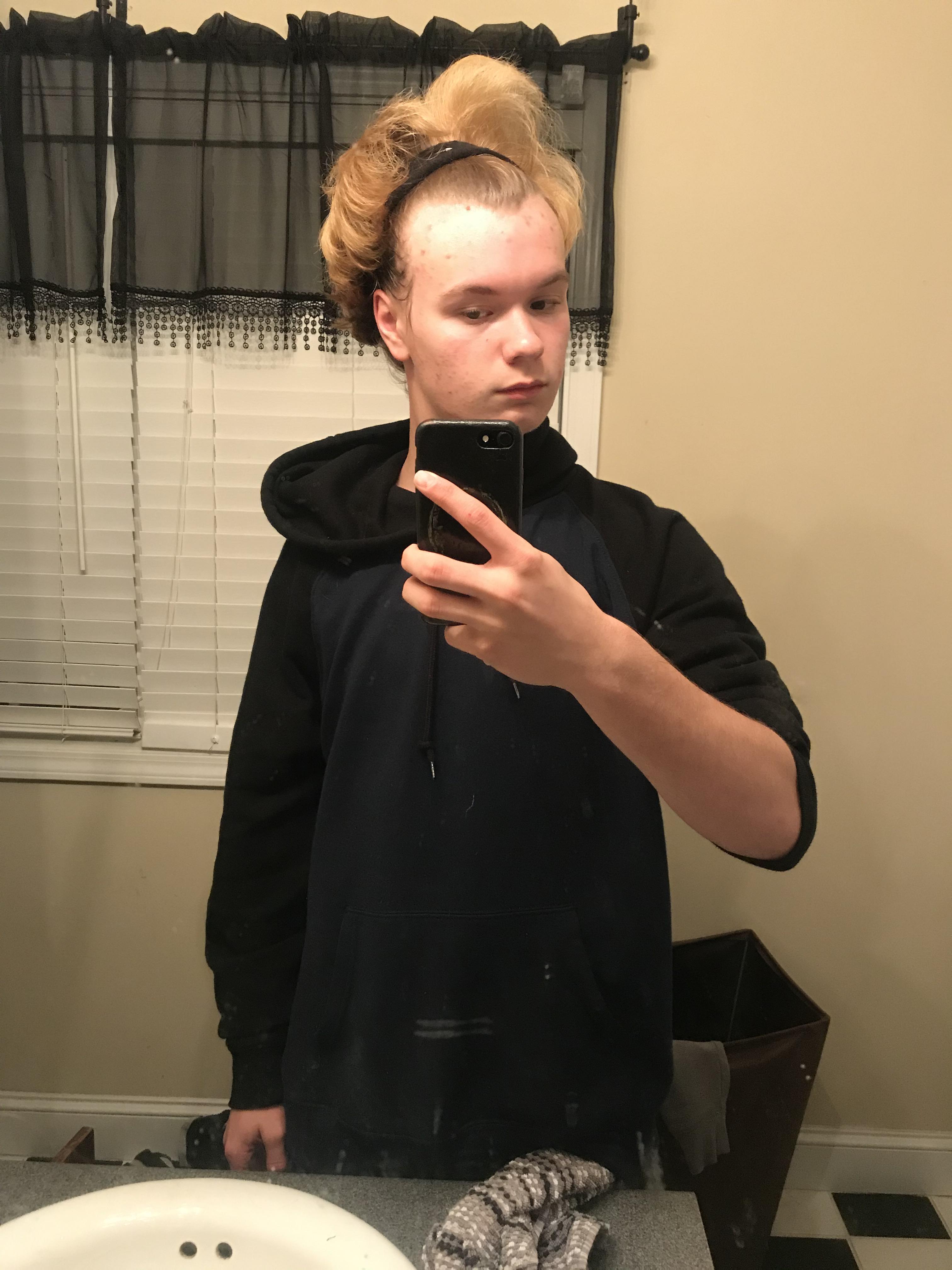 15 year old receding hairline or just big forehead? | Scrolller