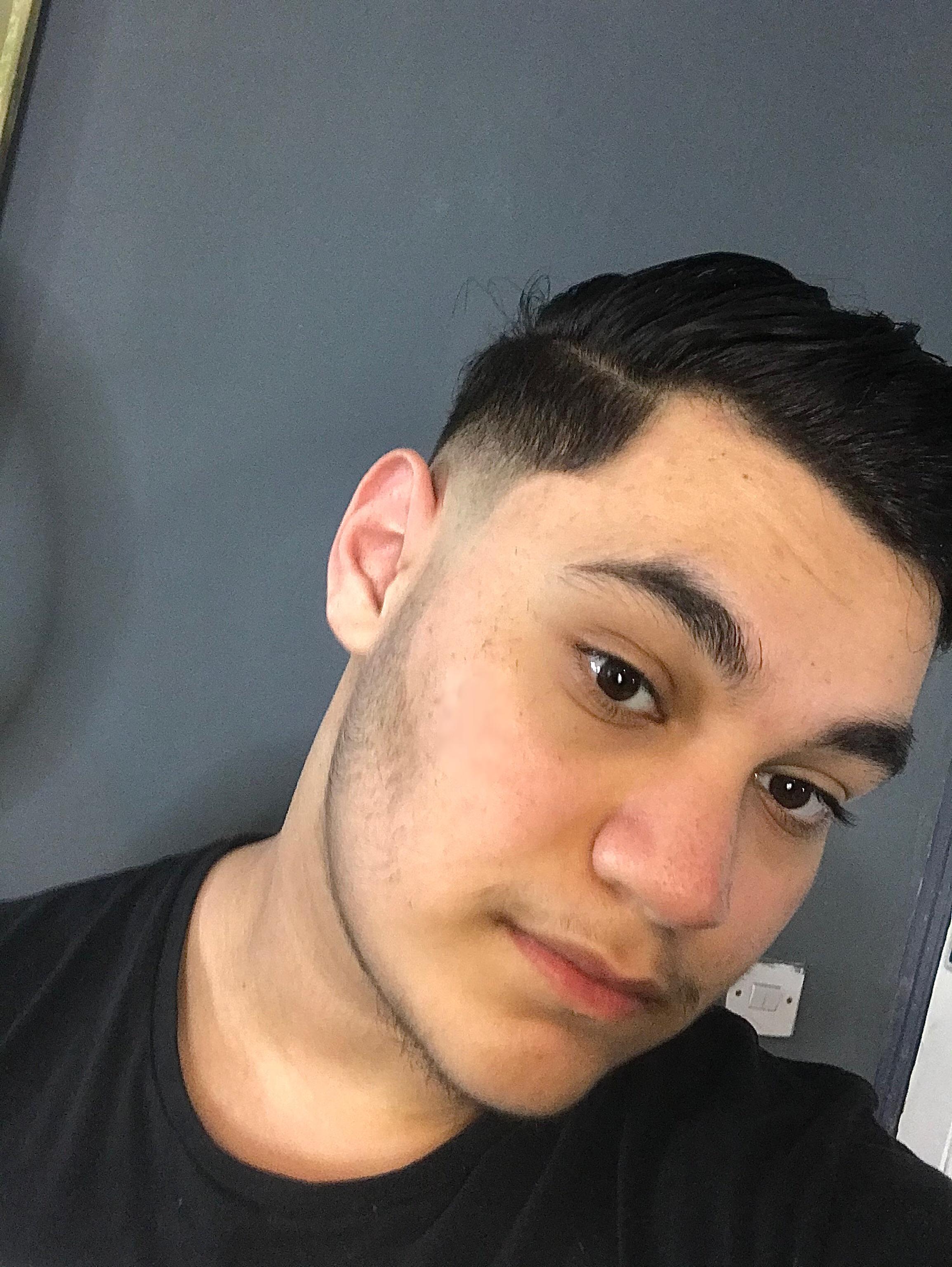 [16M] am I ugly? | Scrolller