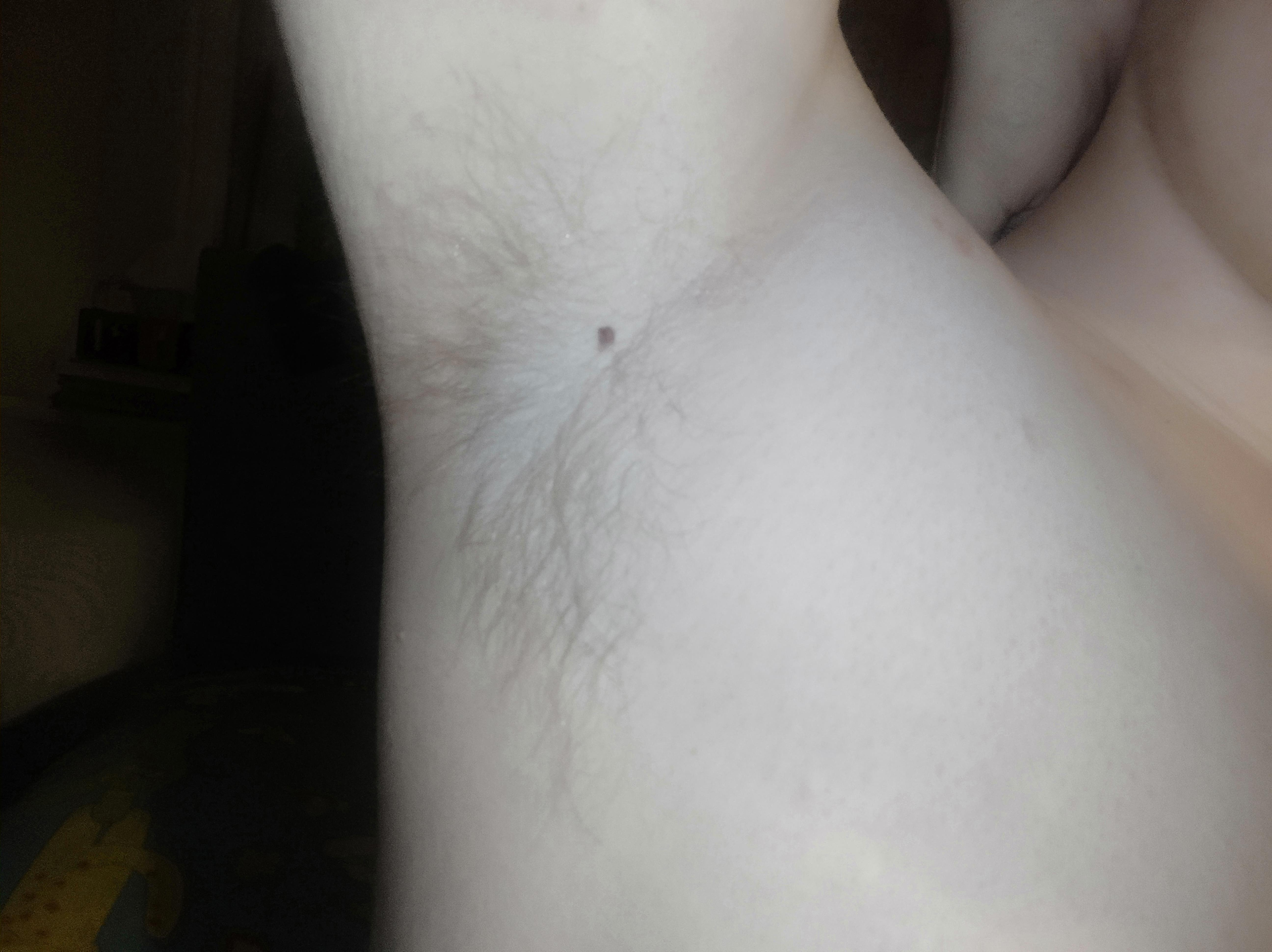 (18) Hairy and smelly | Scrolller