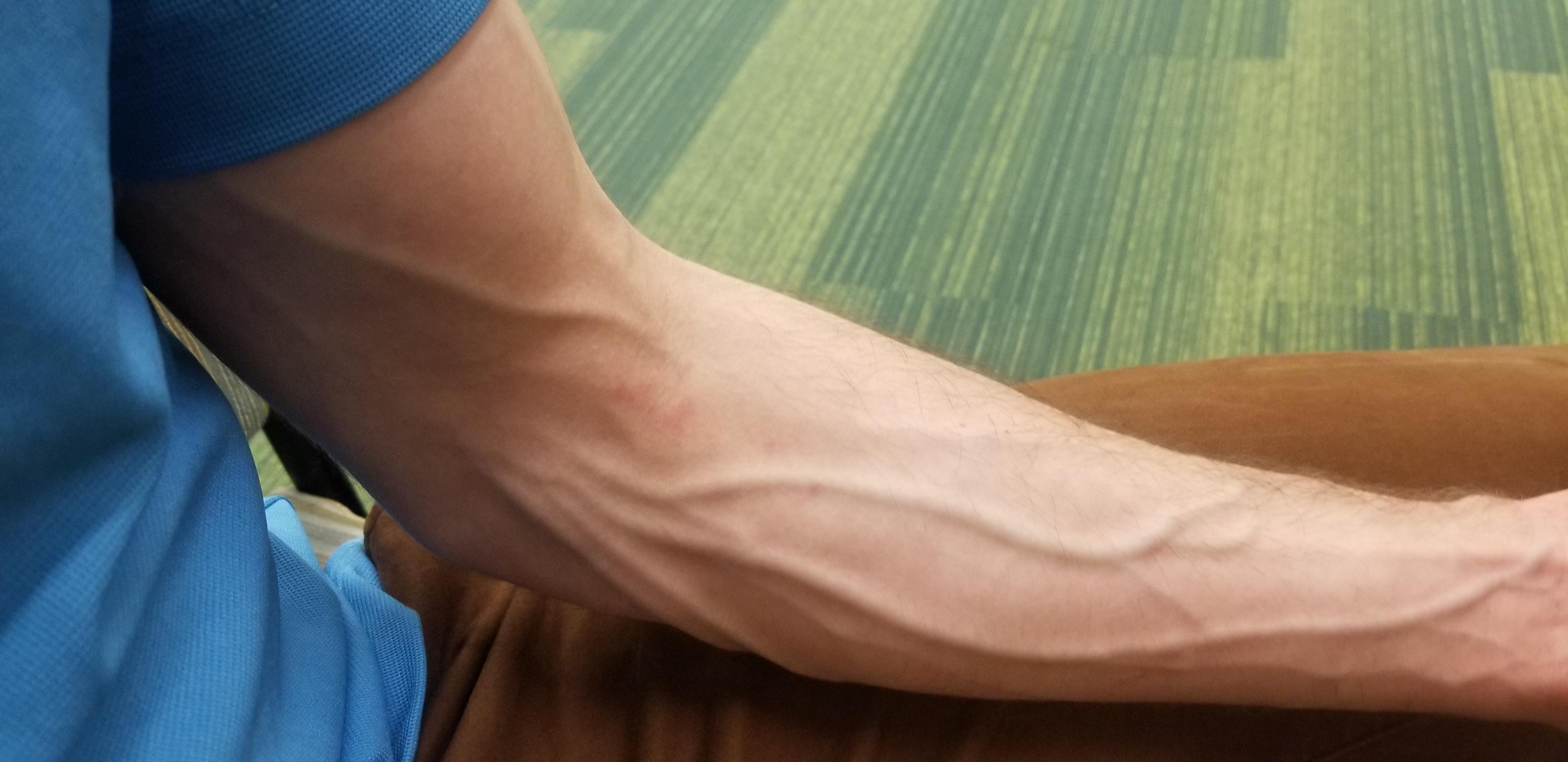 1st post. Library arm. | Scrolller