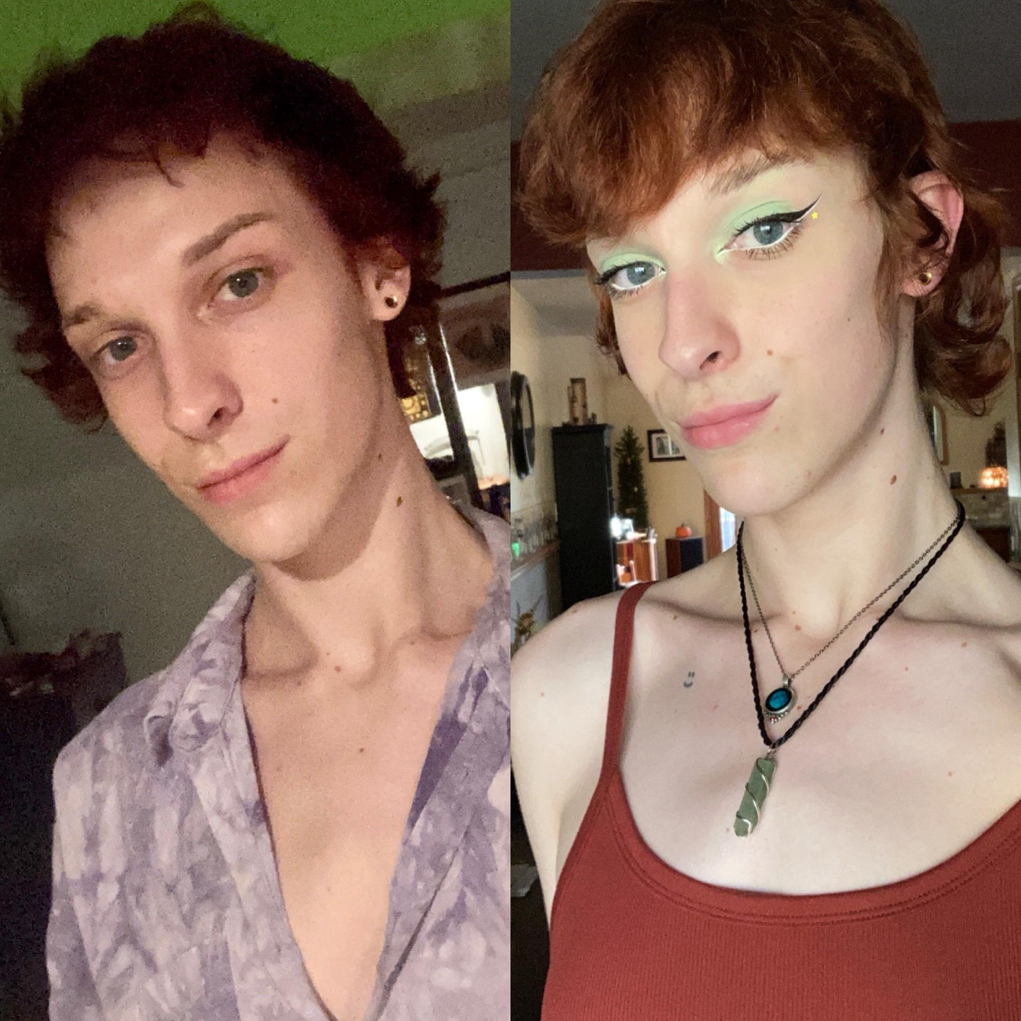 23 MtNB Day 1 vs 3 months hrt ! | Scrolller