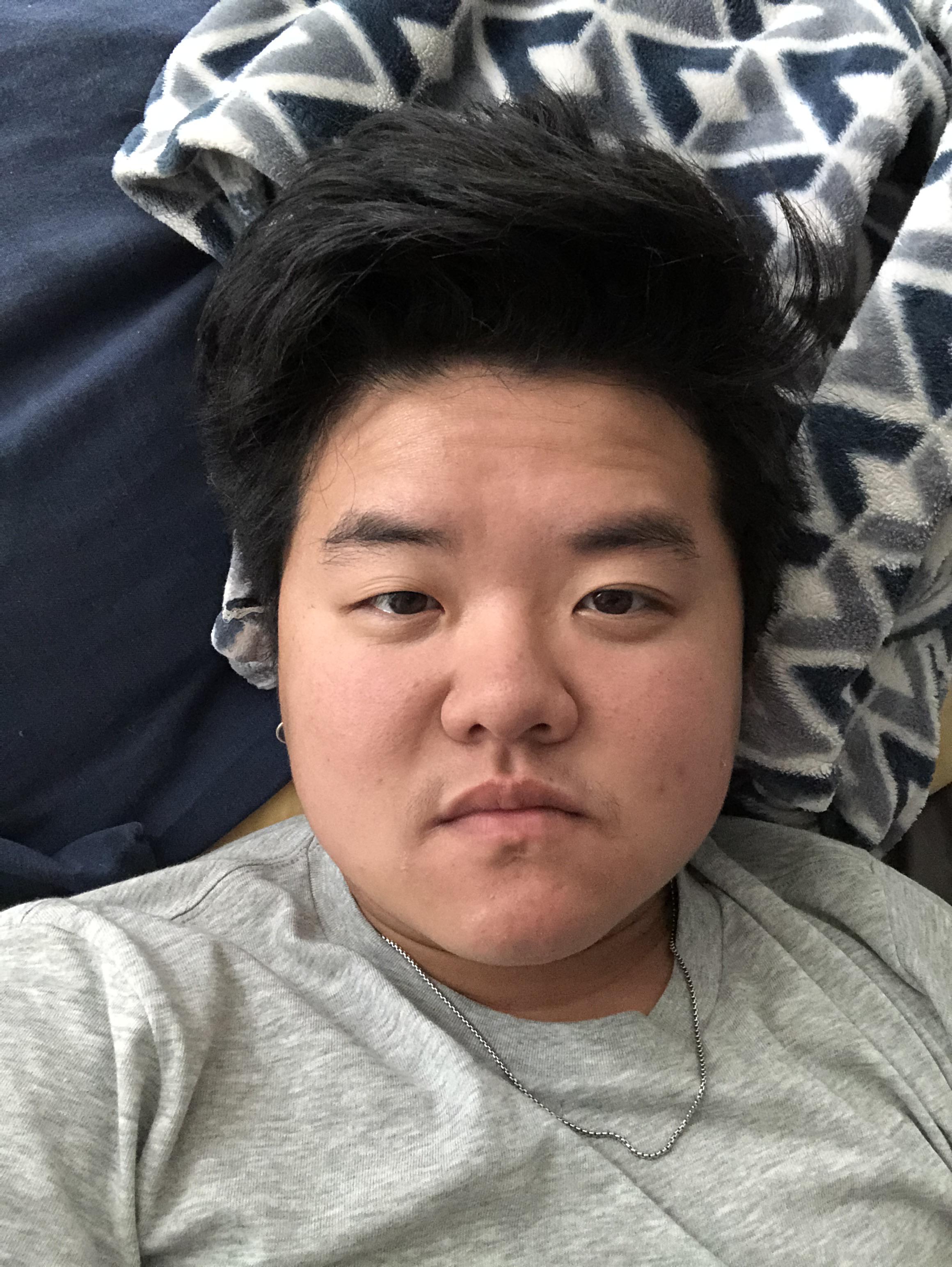 25 FTM 2 years, 4 months on T! | Scrolller