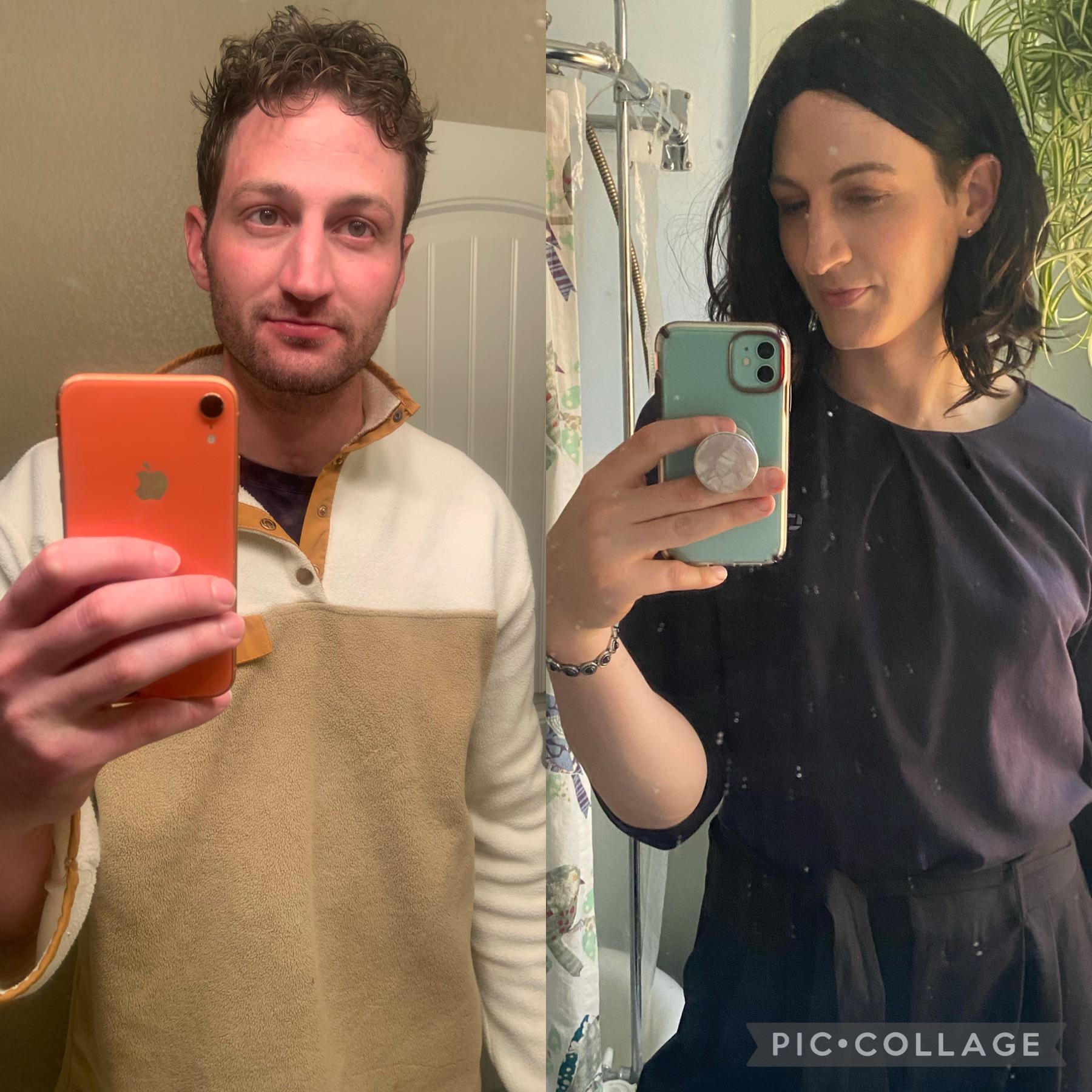 29 MtF almost 7 months HRT | Scrolller