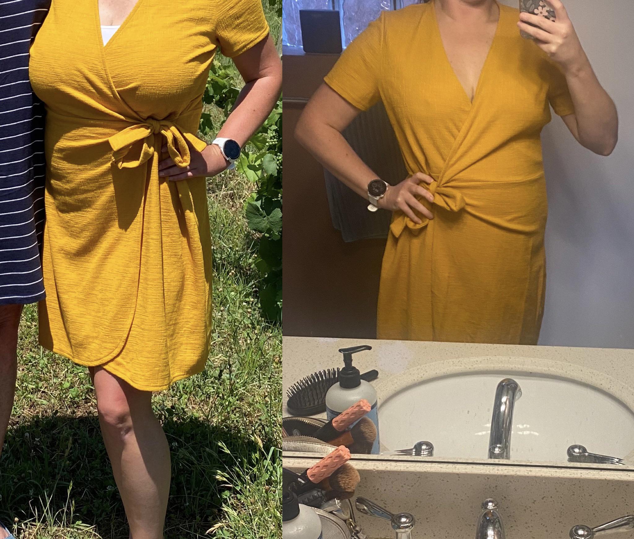 38G > 38DD (4.5 weeks PO) | Scrolller