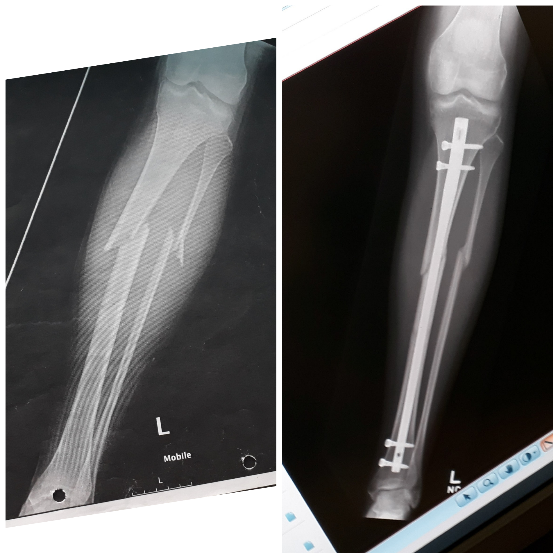4 months between x-rays! | Scrolller