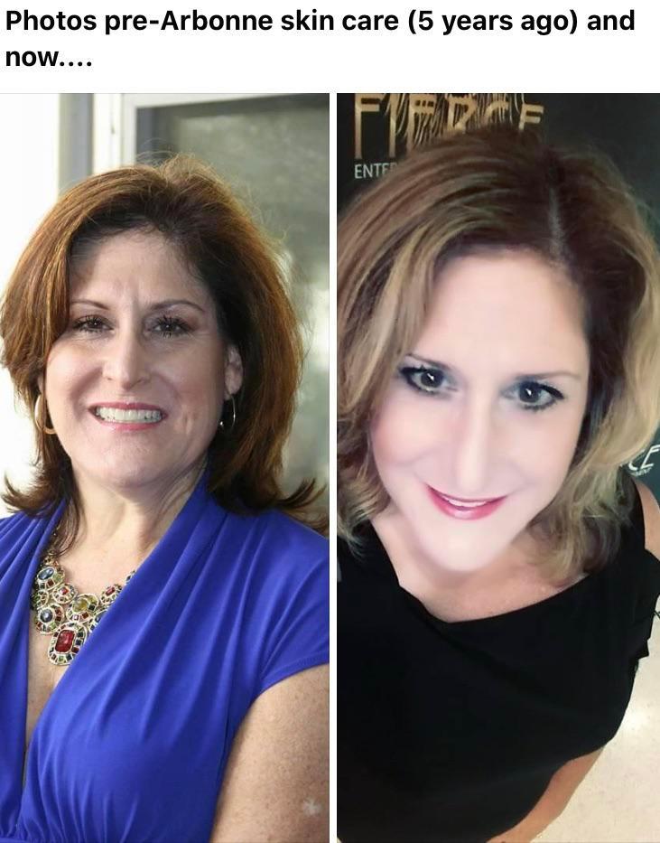 5 years difference after using Arbonne 😂 | Scrolller