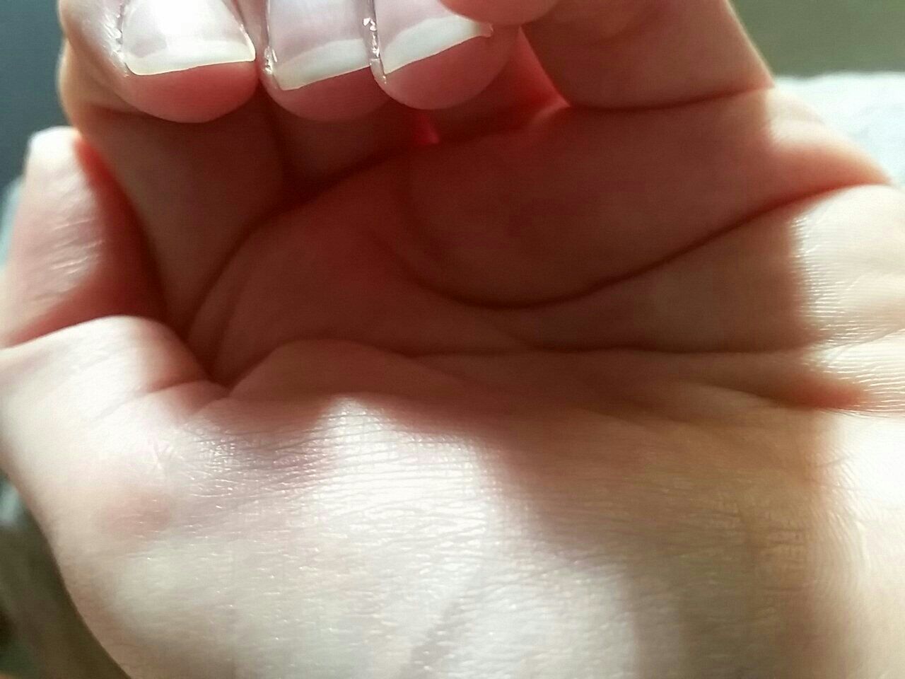 A different angle of my Palm | Scrolller