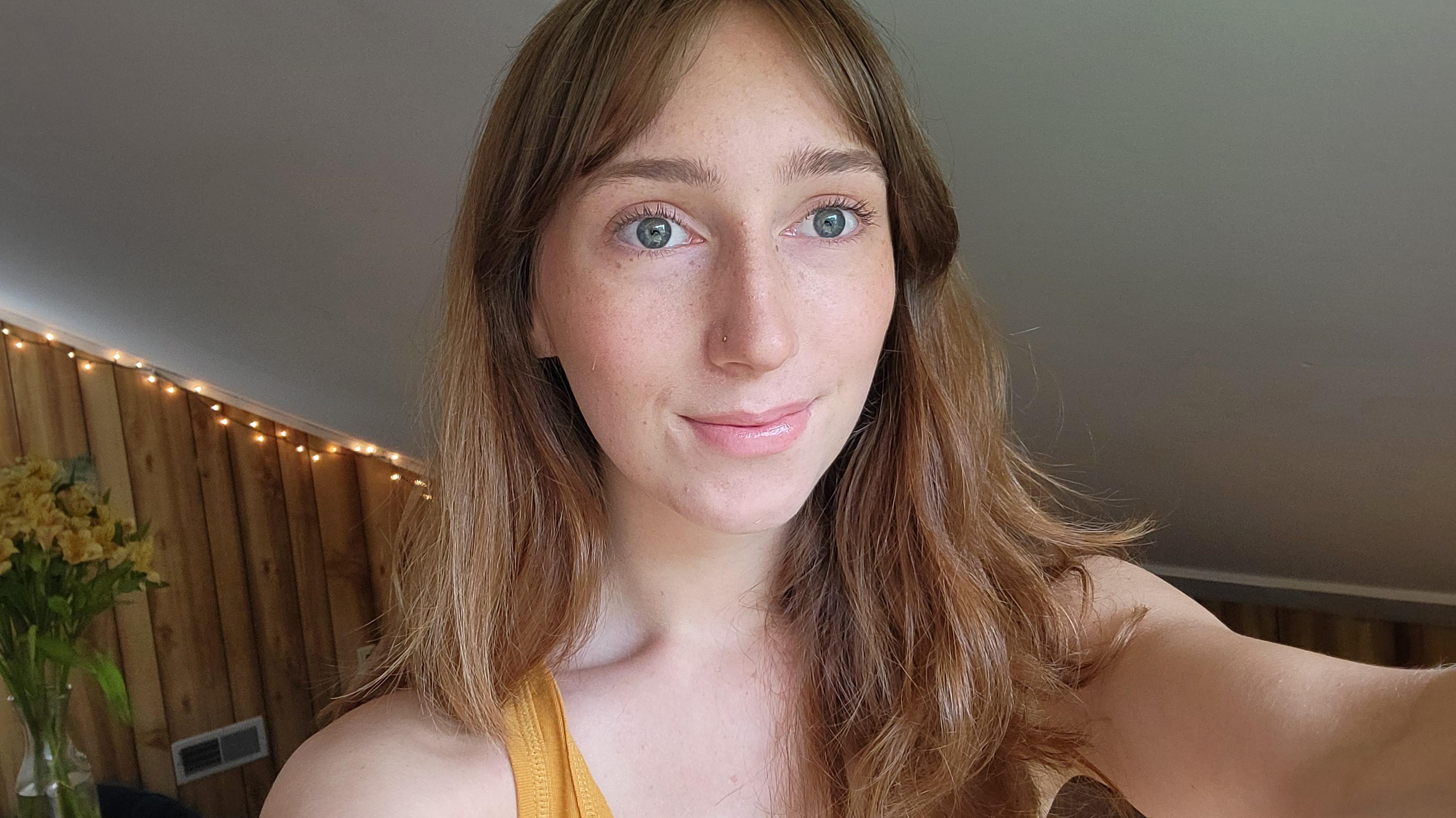 A Speckle Of Freckles π Scrolller