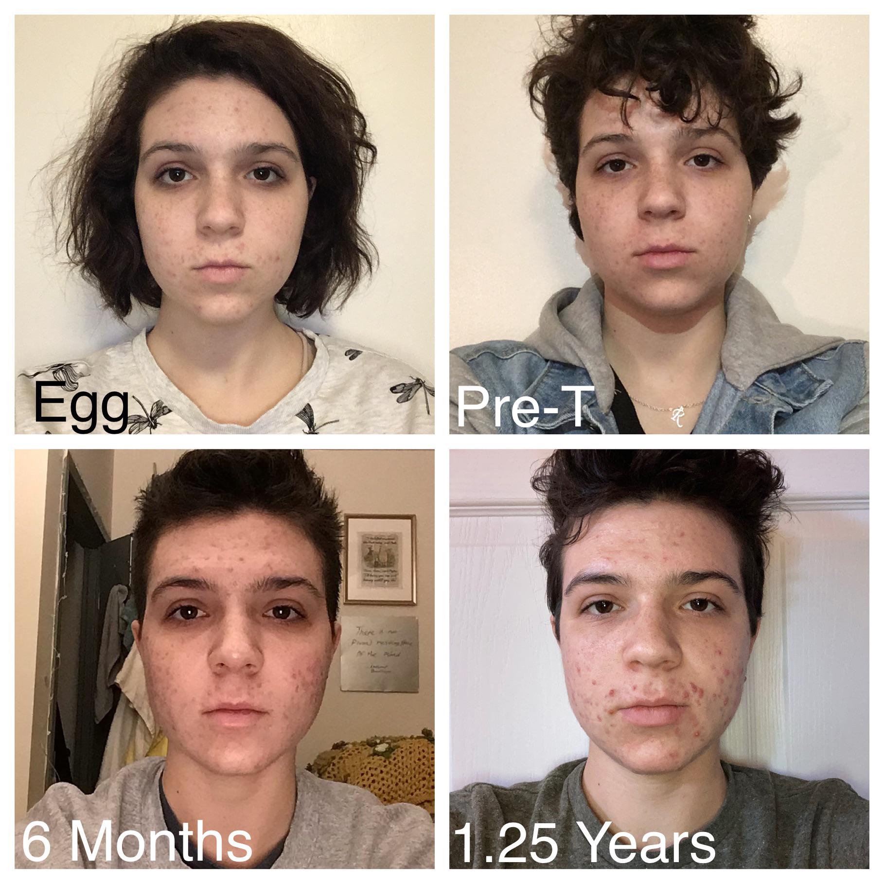 A timeline of awkward flash selfies | Scrolller