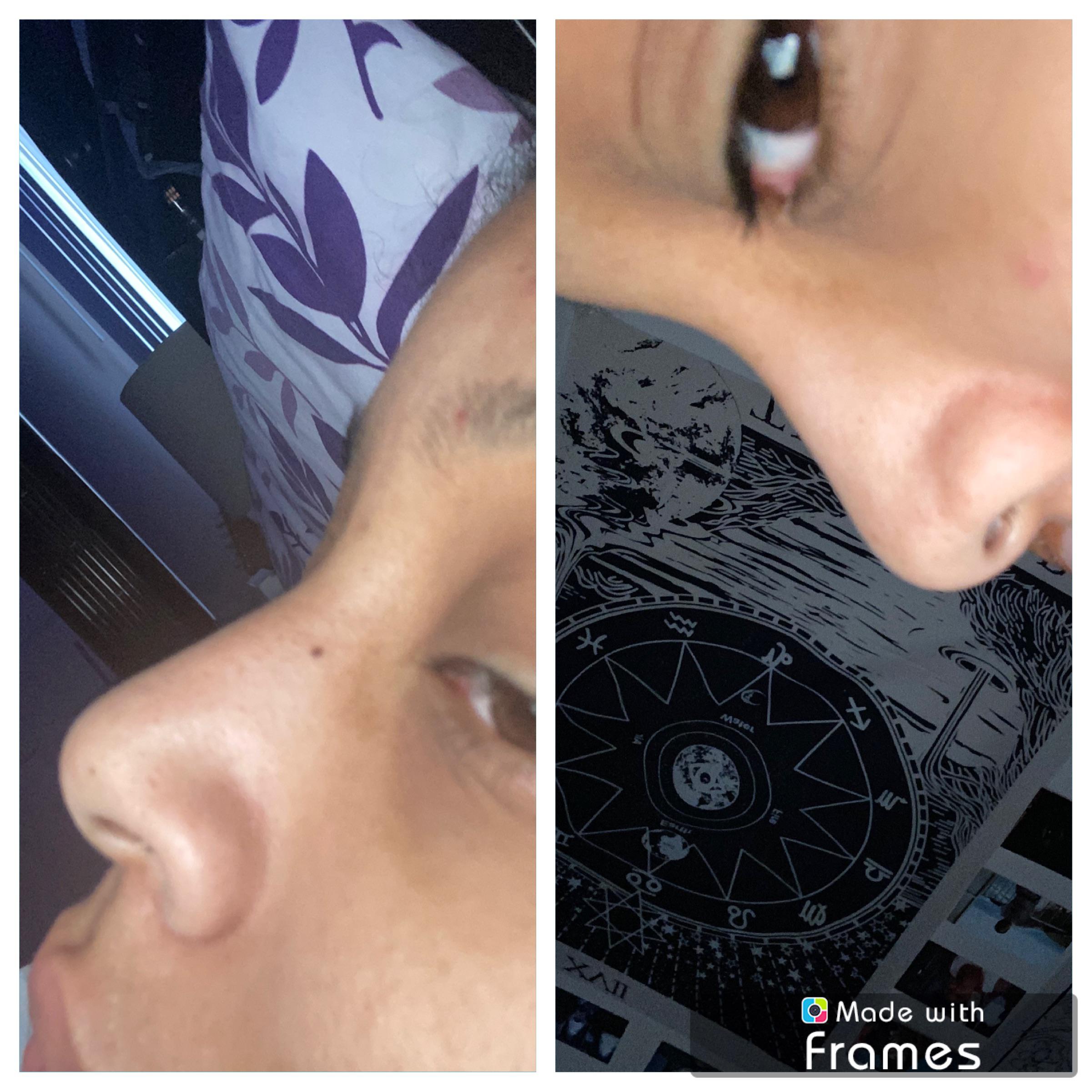 after one night it seems as if my nose already has more of a curve !! love the results, trying ...