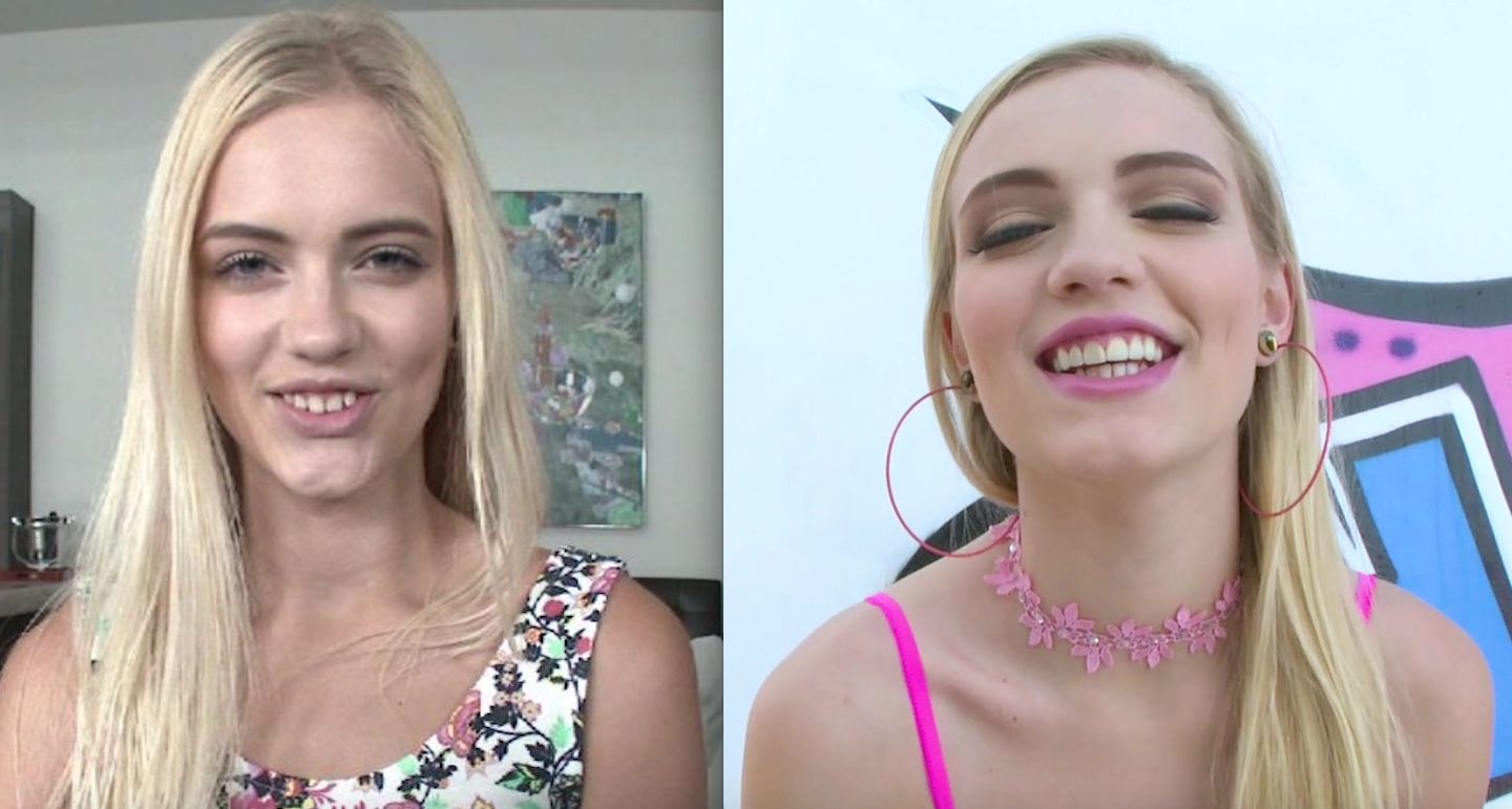 Alex Grey's New Teeth | Scrolller