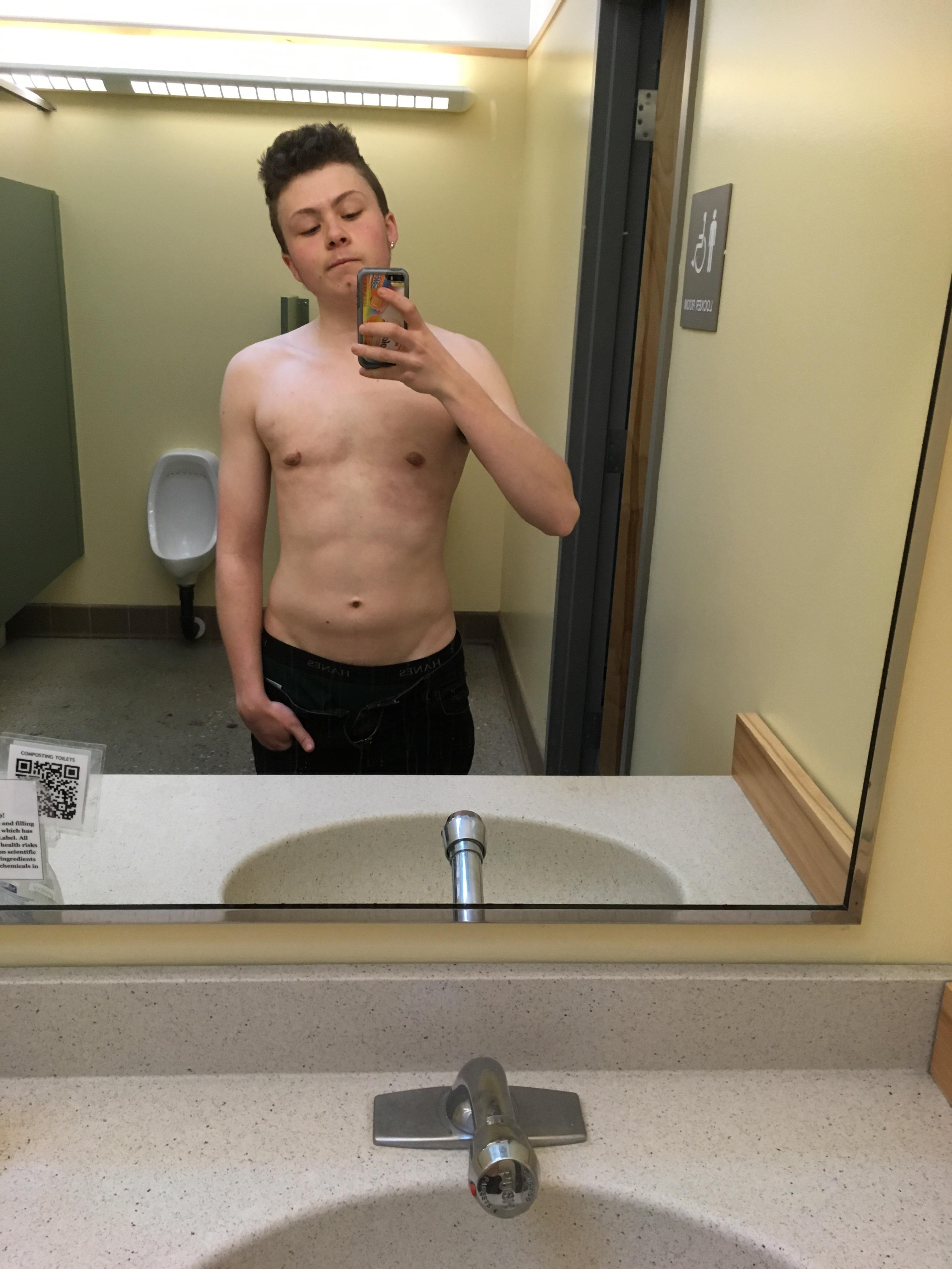 almost 1 month post op, peri | Scrolller