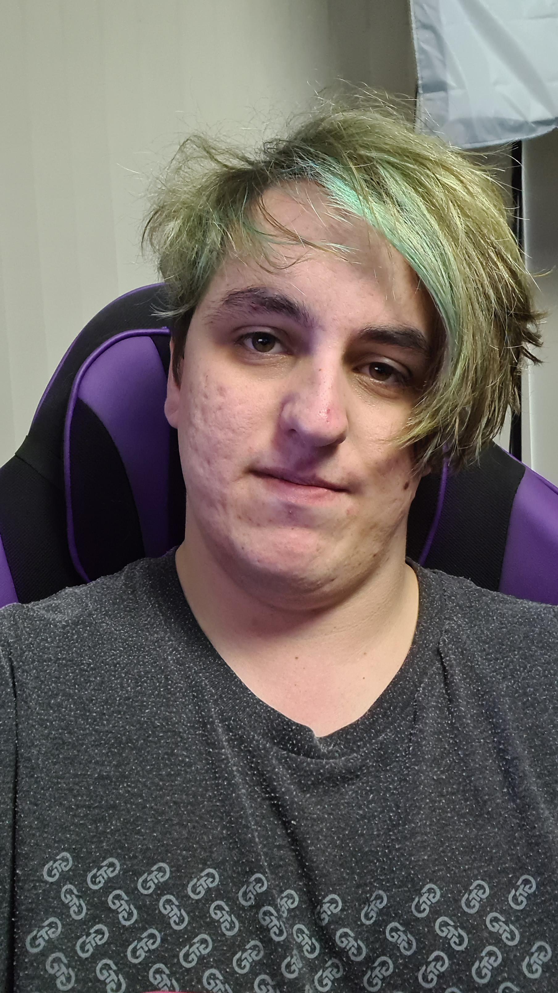 AMAB MtF - Just started HRT again after my hormones hit CIS levels, so basically back at pre ...