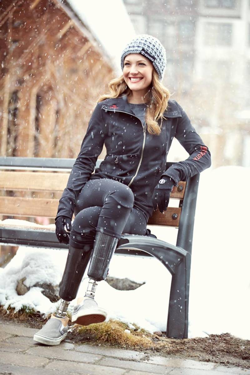 Amy Purdy | Scrolller