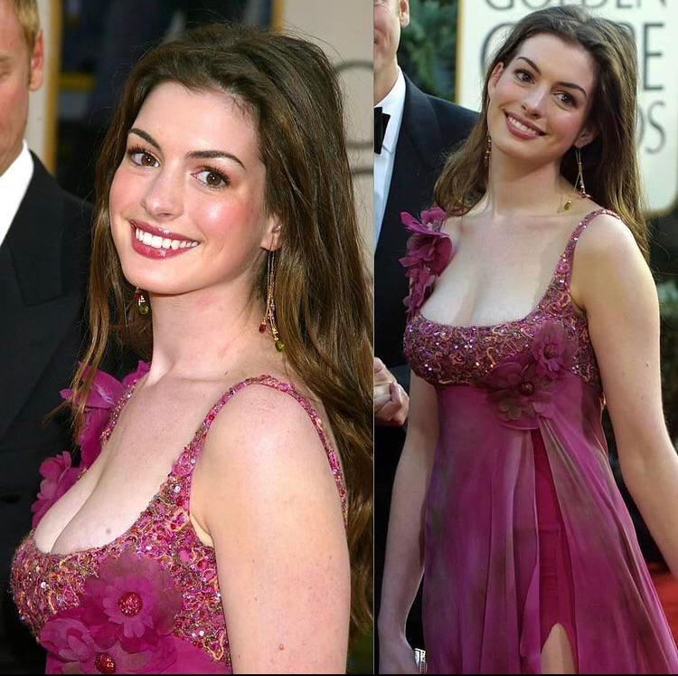 Anne Hathaway and her absolutely immaculate tits. | Scrolller