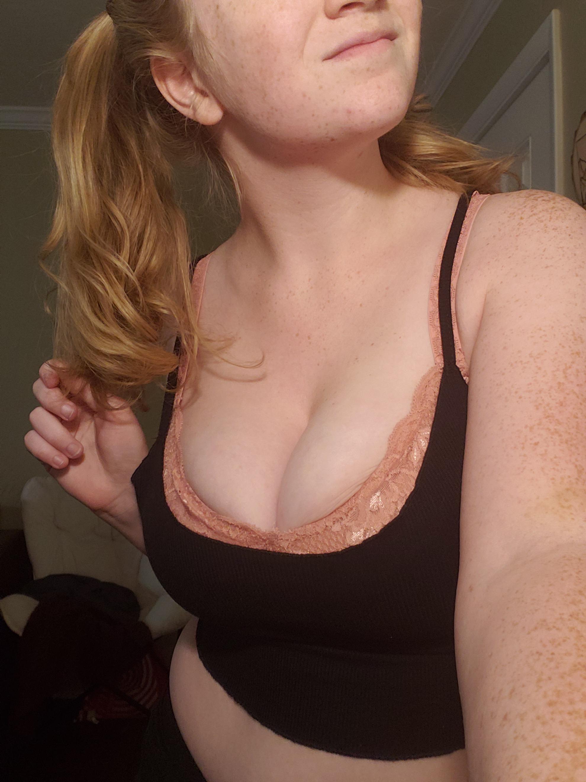 Anyone here a fan of freckled gingers? | Scrolller