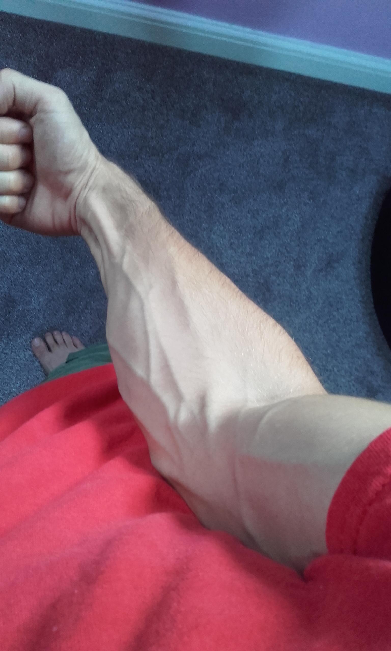 Back again | Scrolller