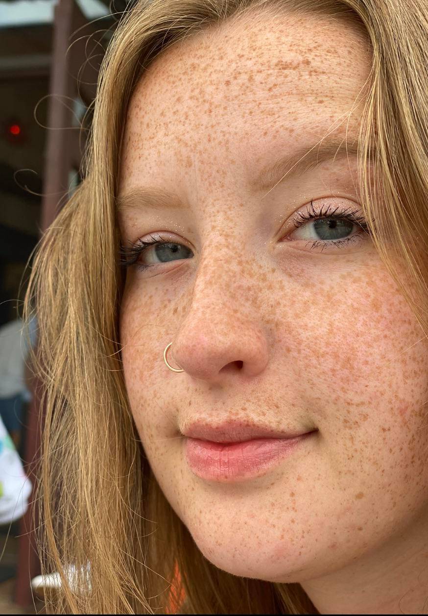 Back in summer, the sun really brings them out 🥰 | Scrolller