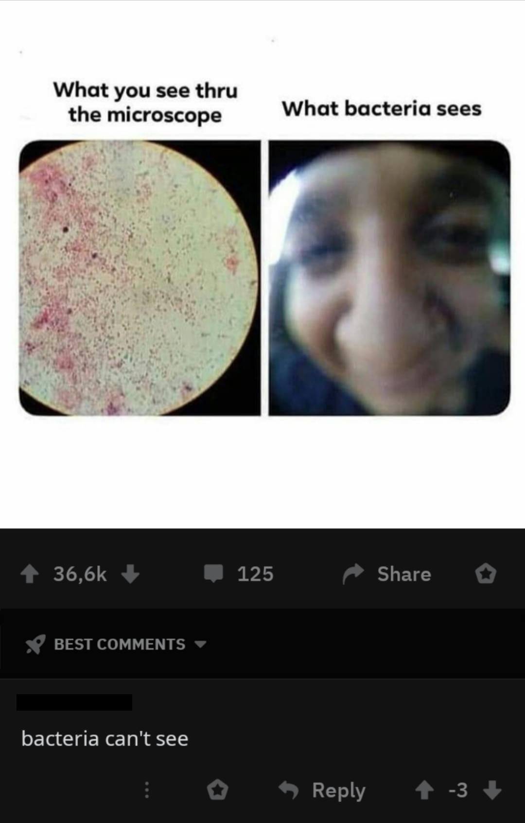 bAcTerIa CaN't sEe | Scrolller