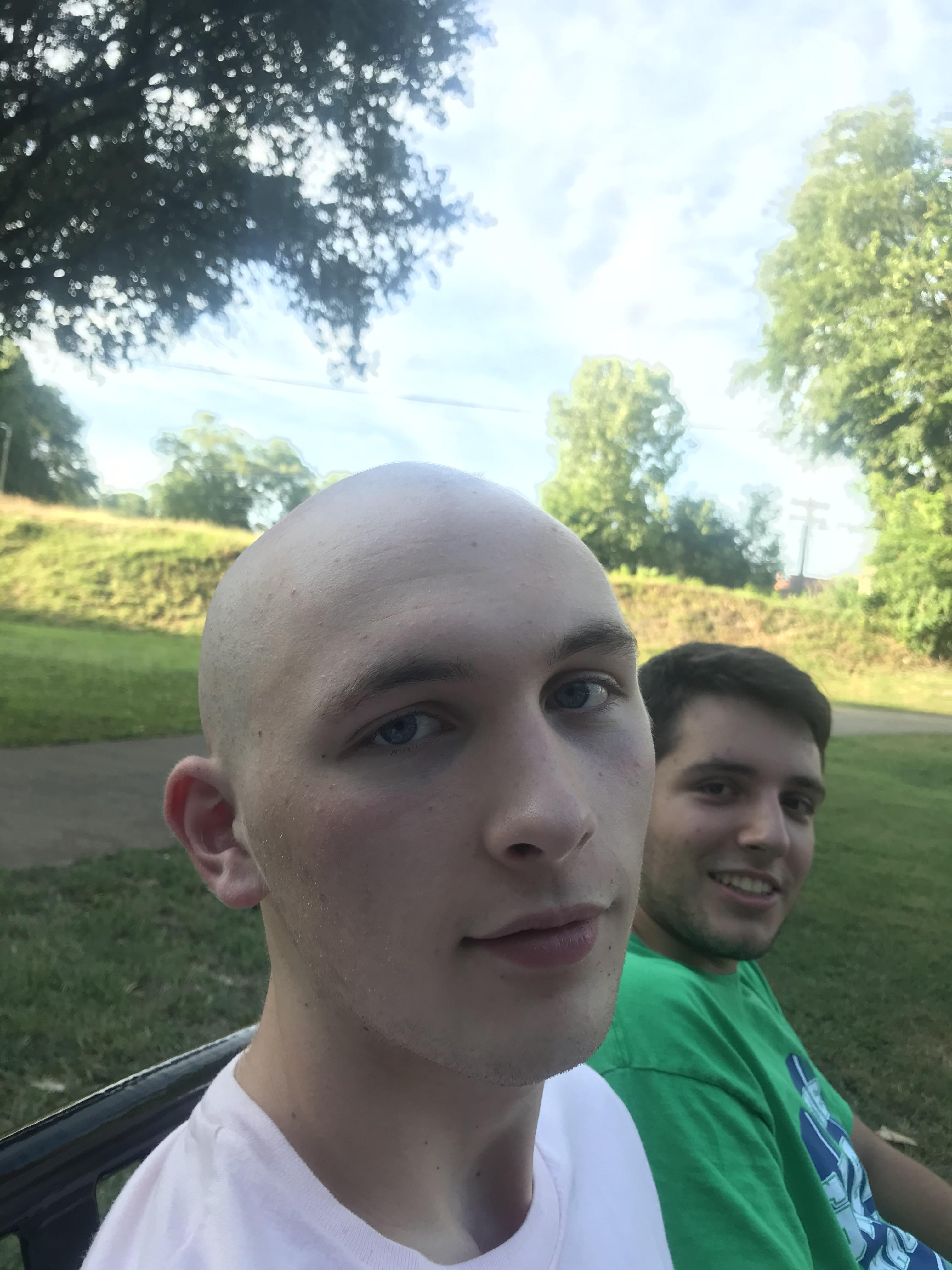 Bald at 17. Feelsgoodman | Scrolller