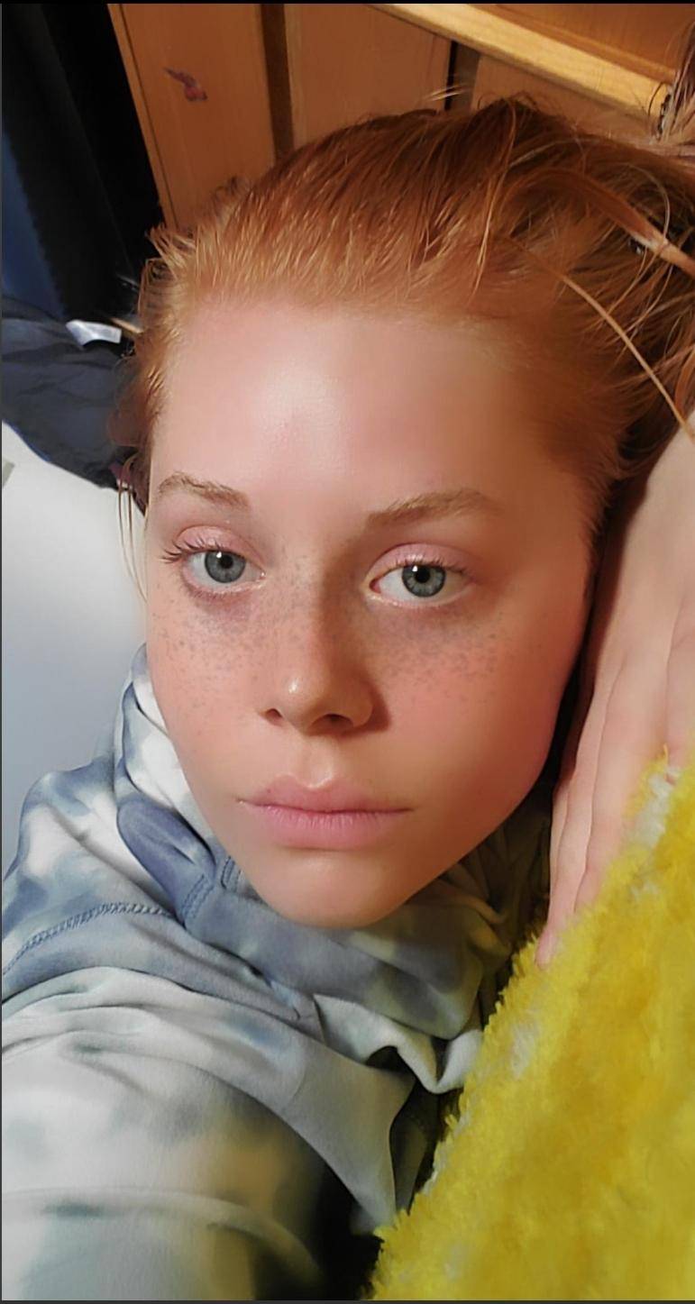 Bare faced and freckled | Scrolller