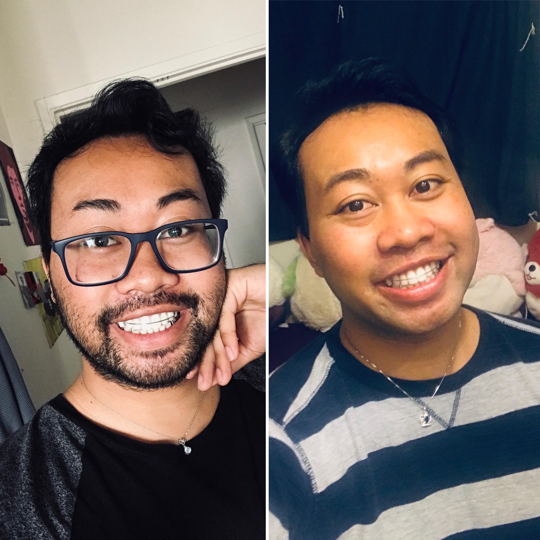 Beard vs No Beard | Scrolller