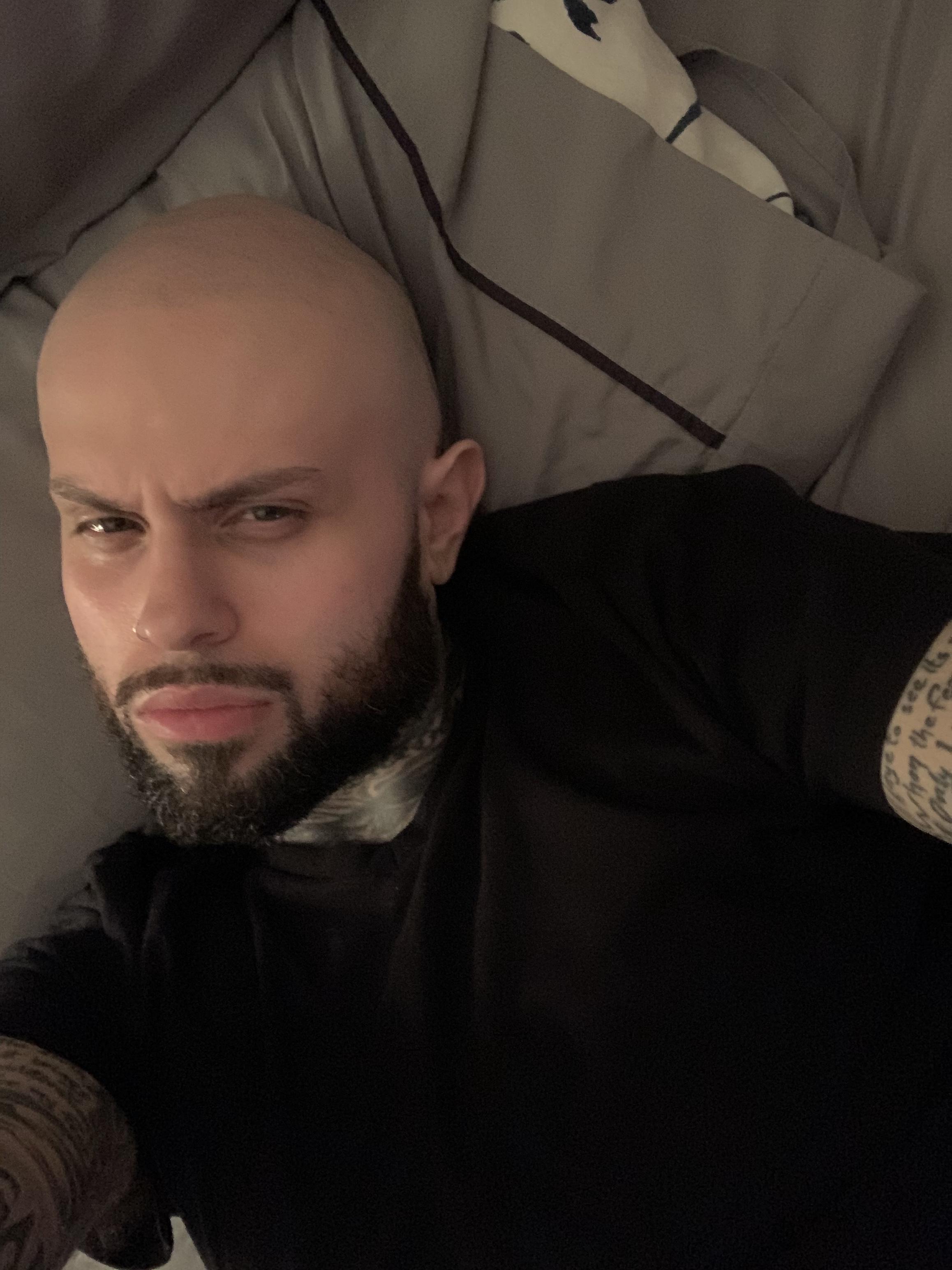 Been bald since 17. It gets easier | Scrolller