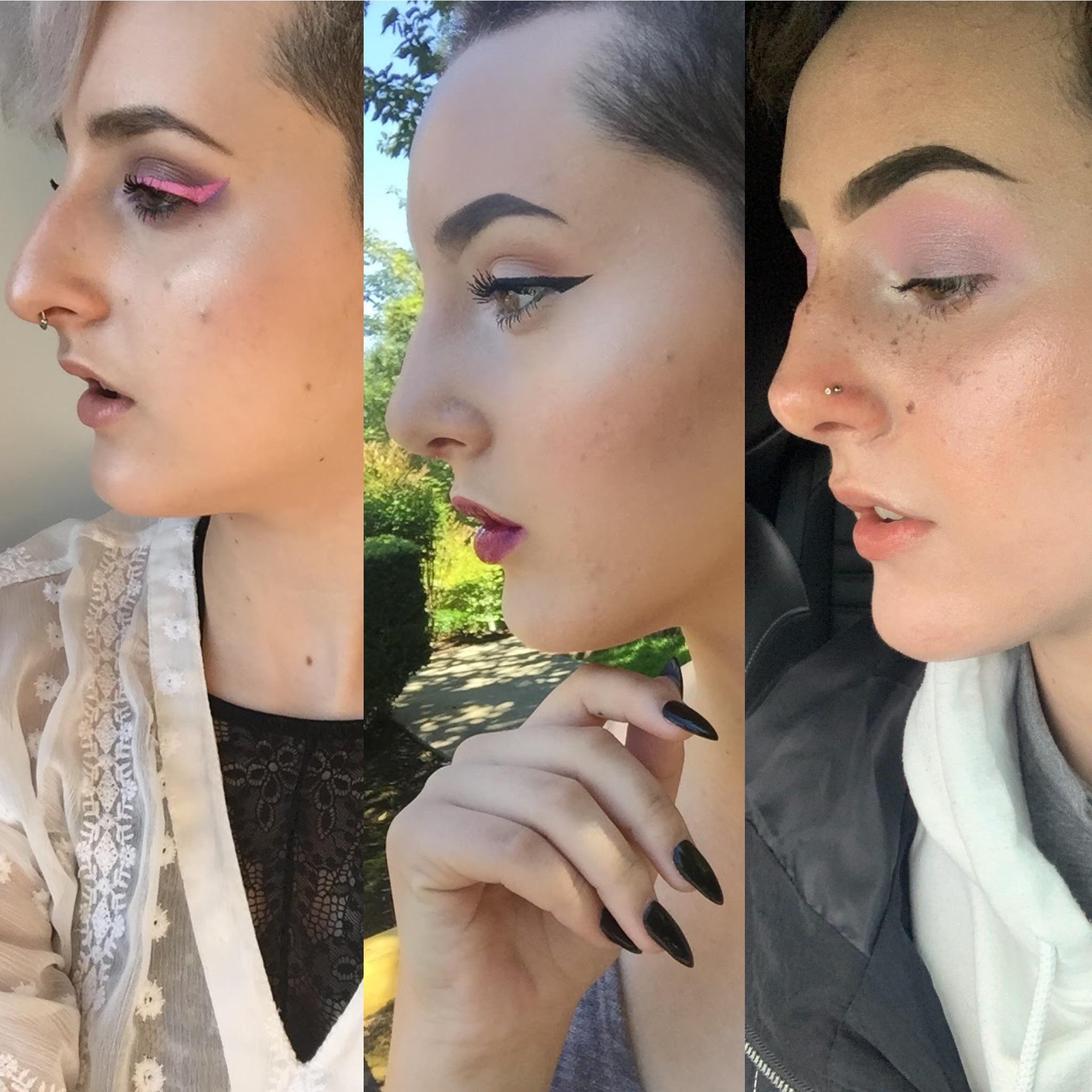 Before, 3 week post, and 3.5 years post nasal reconstruction by Dr. Nuara in Seattle, WA. The ...