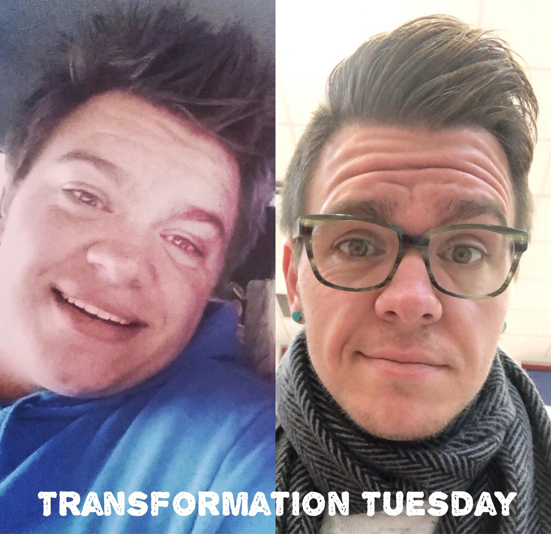 Before and after! | Scrolller