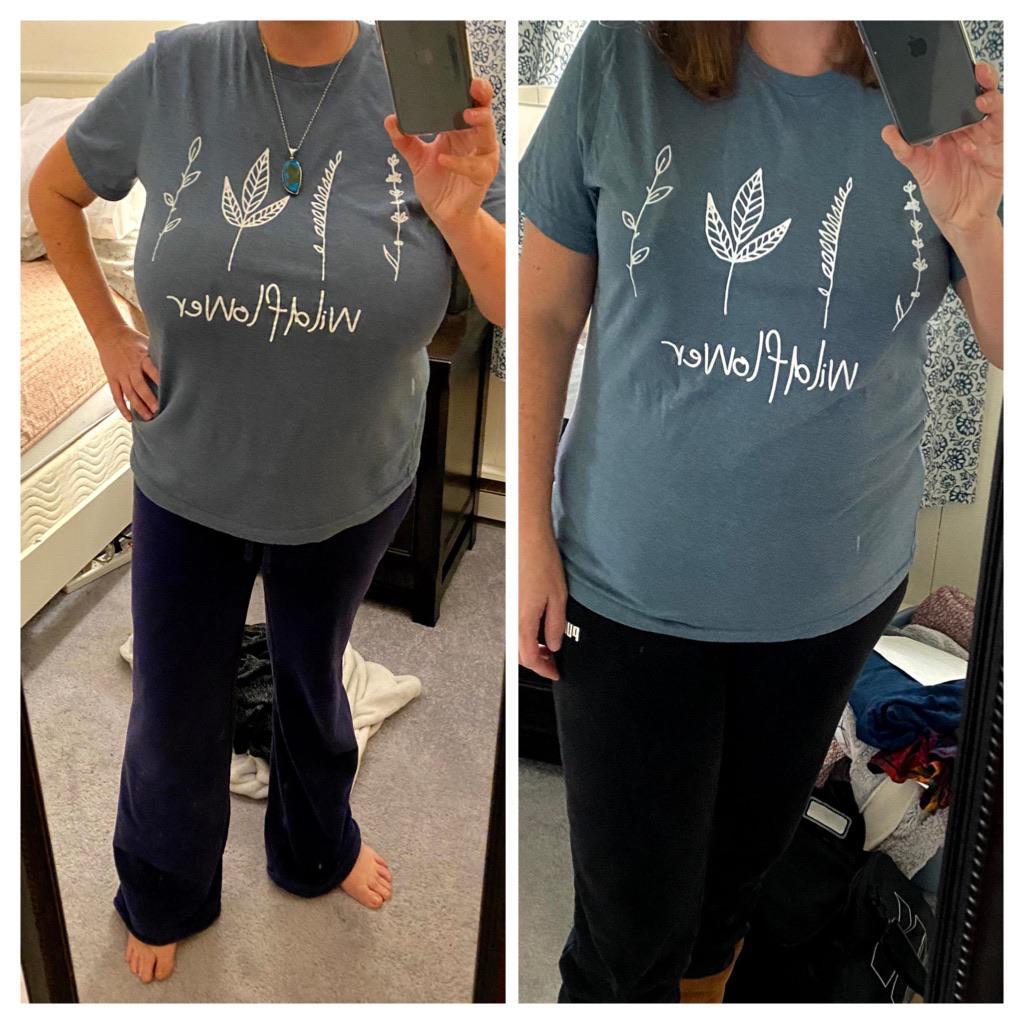 Before and after pics, SO happy with my results. 2 weeks post op | Scrolller