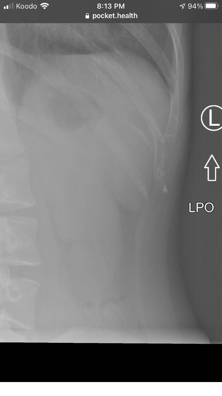 Bottom/front of rib. Does this look normal? | Scrolller