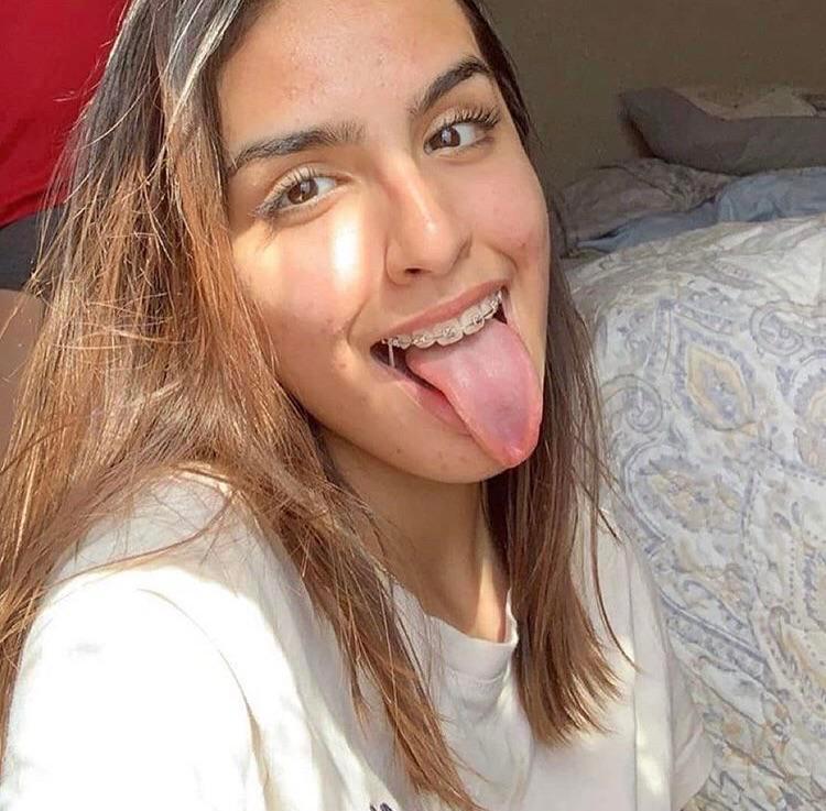 Brace face | Scrolller